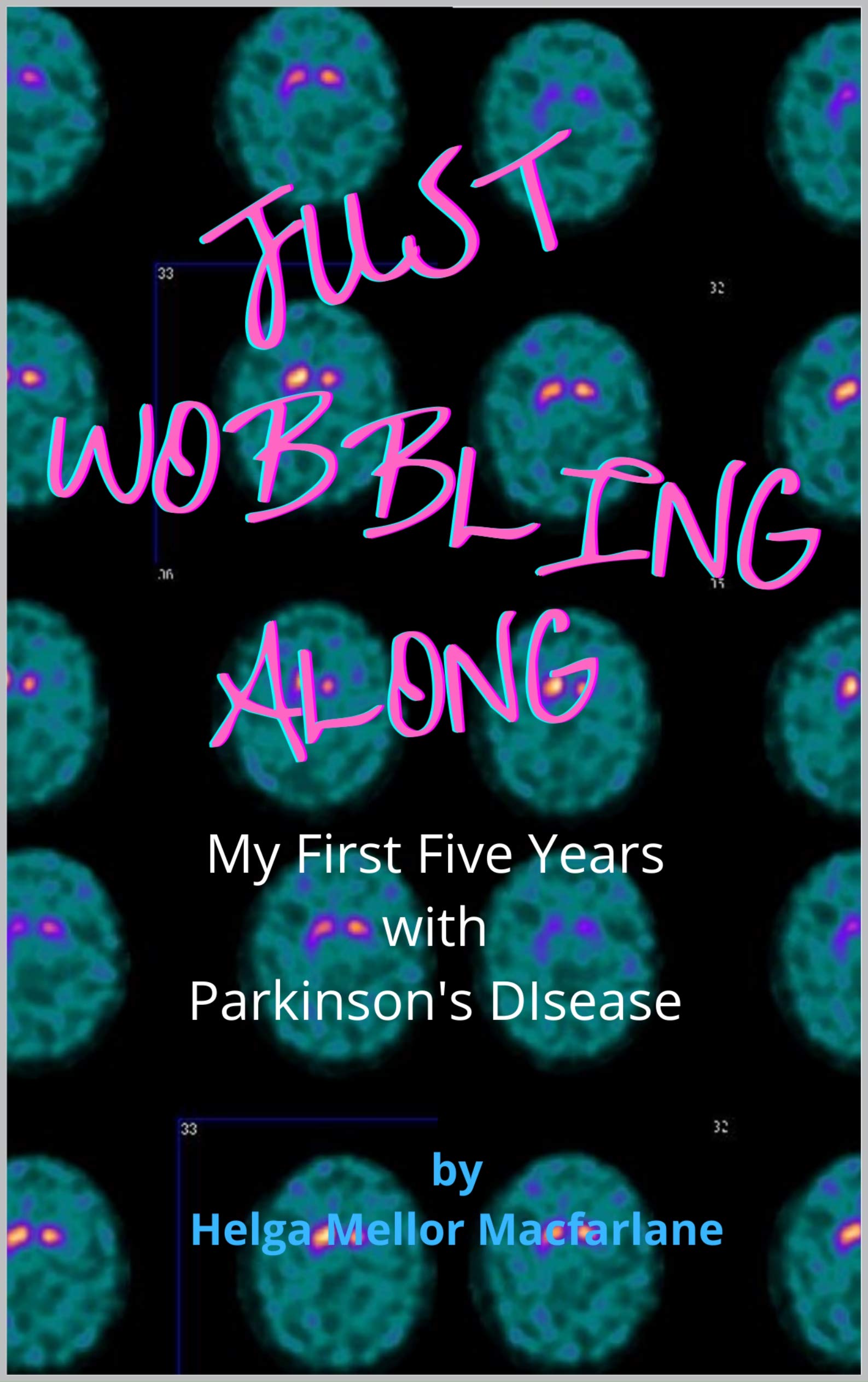 JUST WOBBLING ALONG: My First Five Years with Parkinson’s Disease by ...