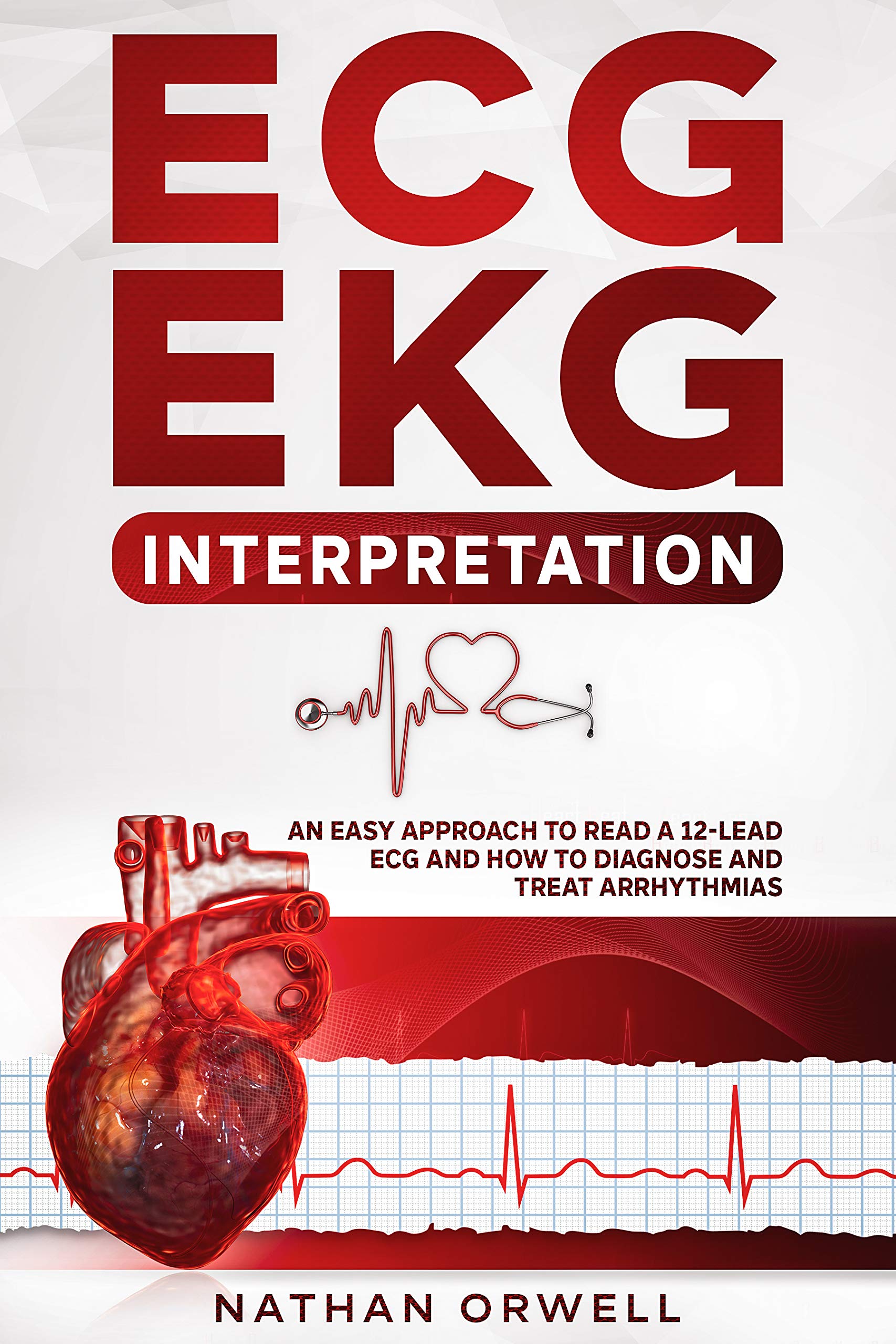 ECG/EKG Interpretation: An Easy Approach to Read a 12-Lead ECG and How ...