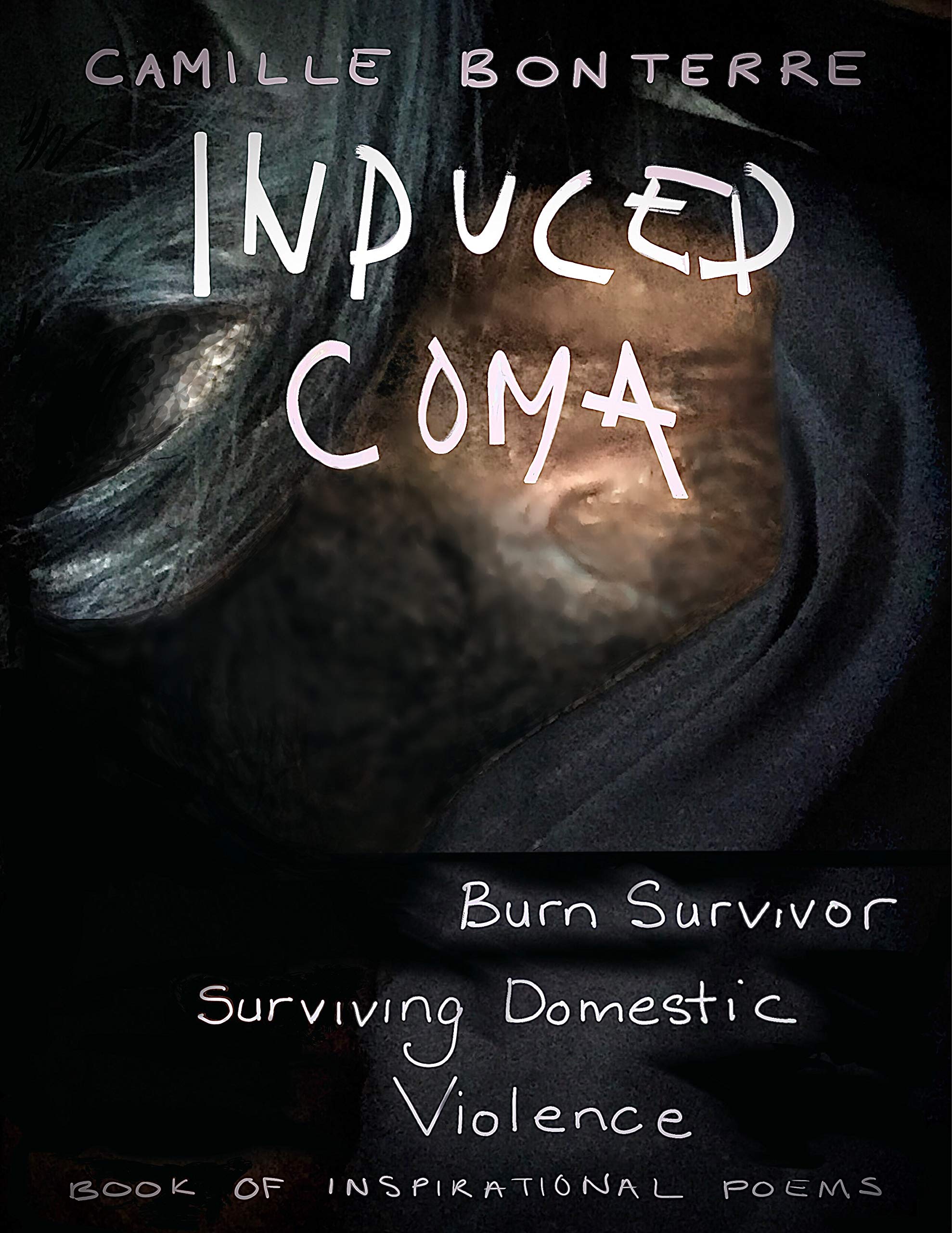 Induced Coma: Burn Survivor, Surviving Domestic Violence : Book of ...
