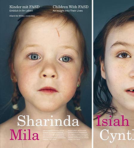 Children With FASD Kinder mit FASD: An Insight Into Their Lives ...