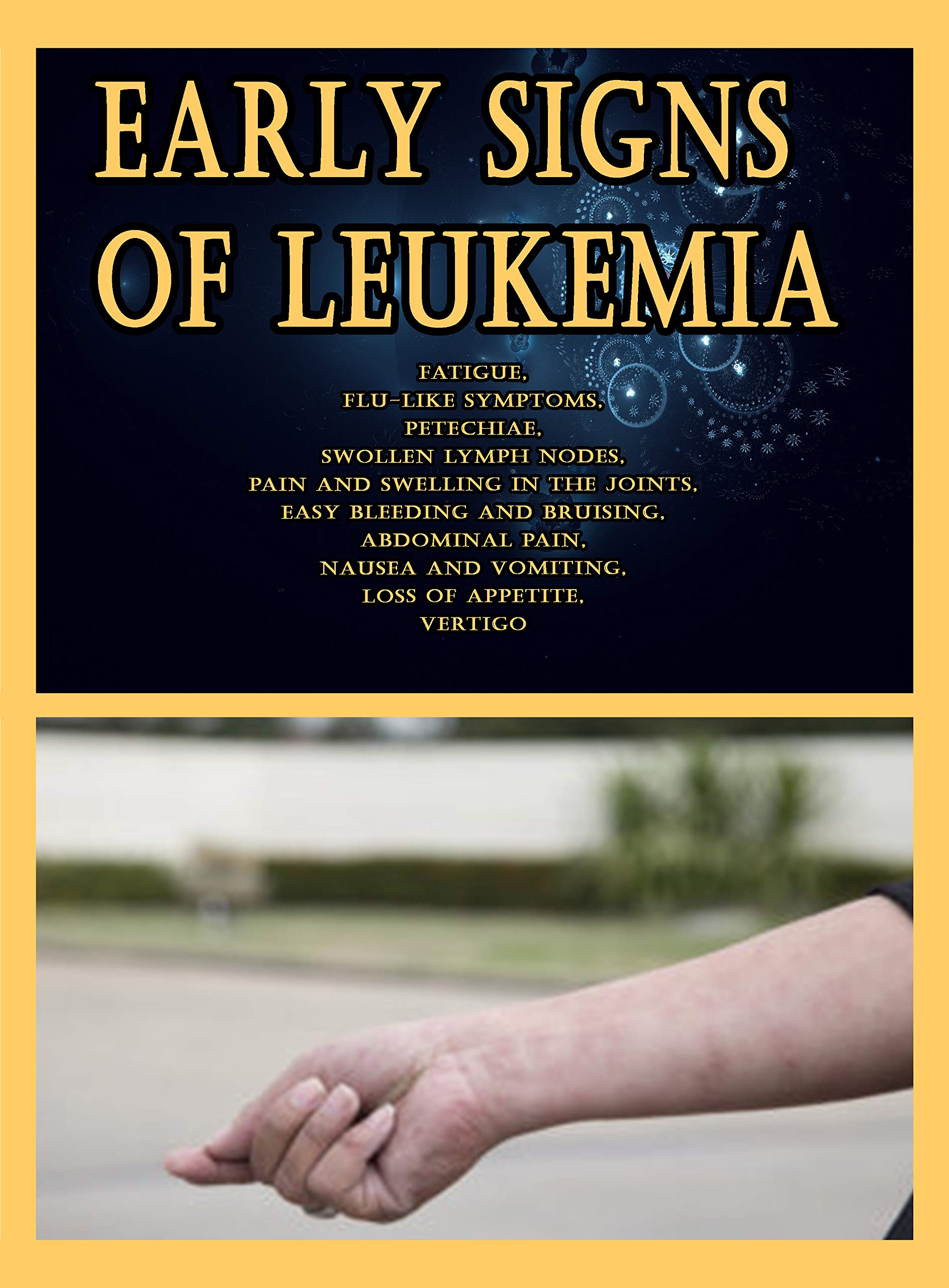 Petechiae Leukemia Symptoms