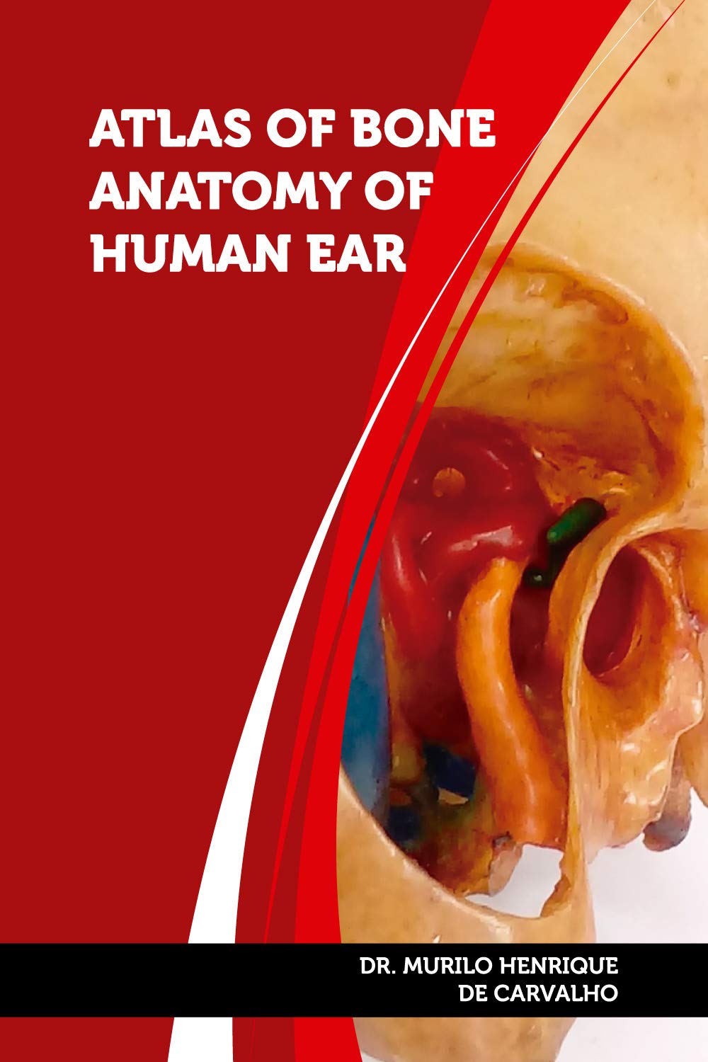 ATLAS OF BONE ANATOMY OF HUMAN EAR by DR. MURILO HENRIQUE DE CARVALHO ...