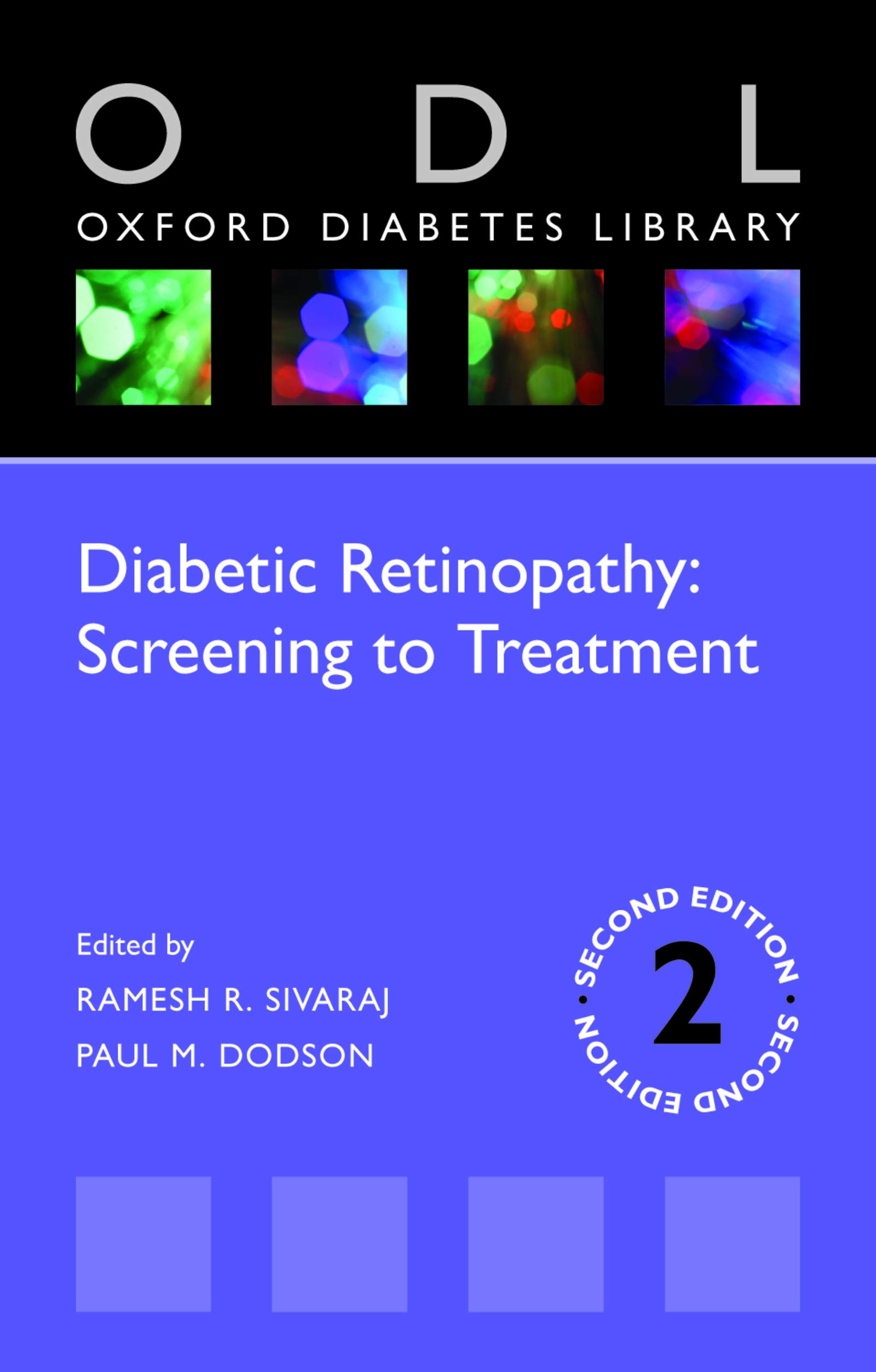 Diabetic Retinopathy Screening To Treatment By Ramesh R Sivaraj Diabetic Retinopathy Screening To Treatment By Ramesh R Sivaraj
