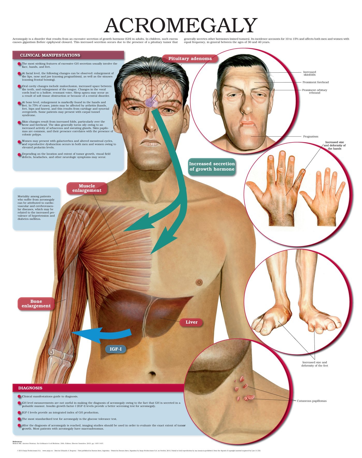 Acromegaly e chart: Full illustrated by HC-HealthComm | Goodreads