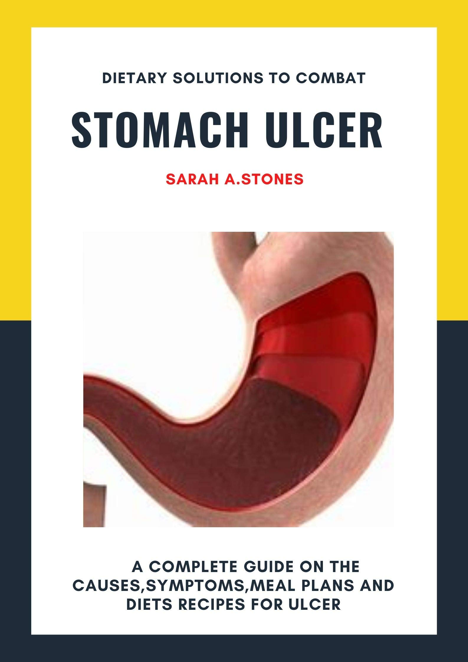 Dietary Solutions To Combat Stomach Ulcer: A Complete Guide On The ...