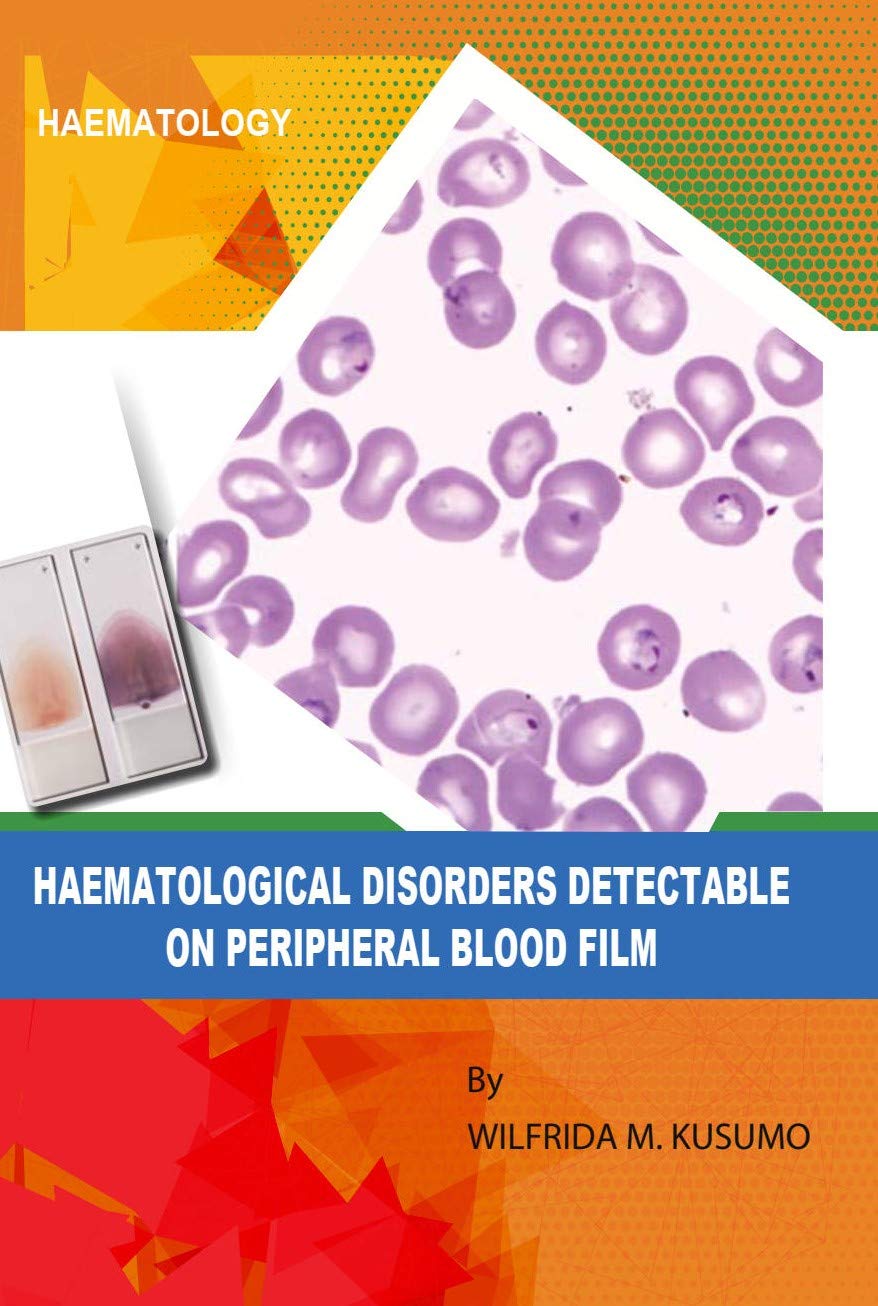 Haematological disorders detectable on peripheral blood film by ...