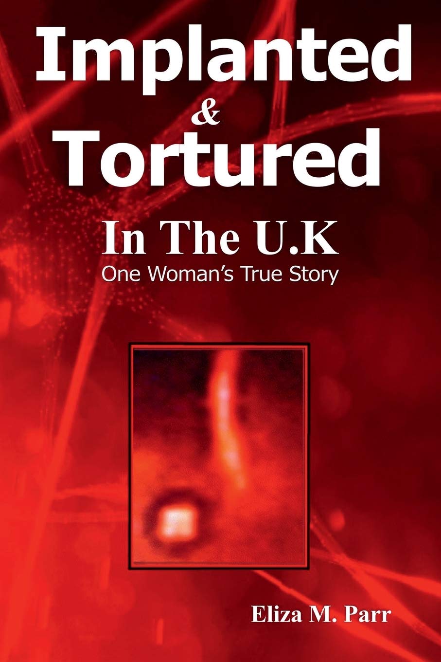 Implanted and Tortured in the U.K. by Eliza M. Parr | Goodreads