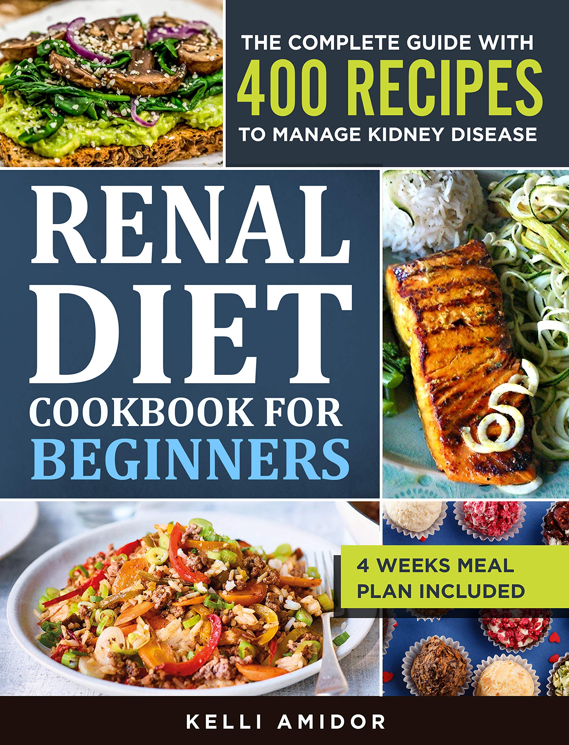 RENAL DIET COOKBOOK FOR BEGINNERS: The Complete Guide with 400 Easy and Delicious Recipes to ...
