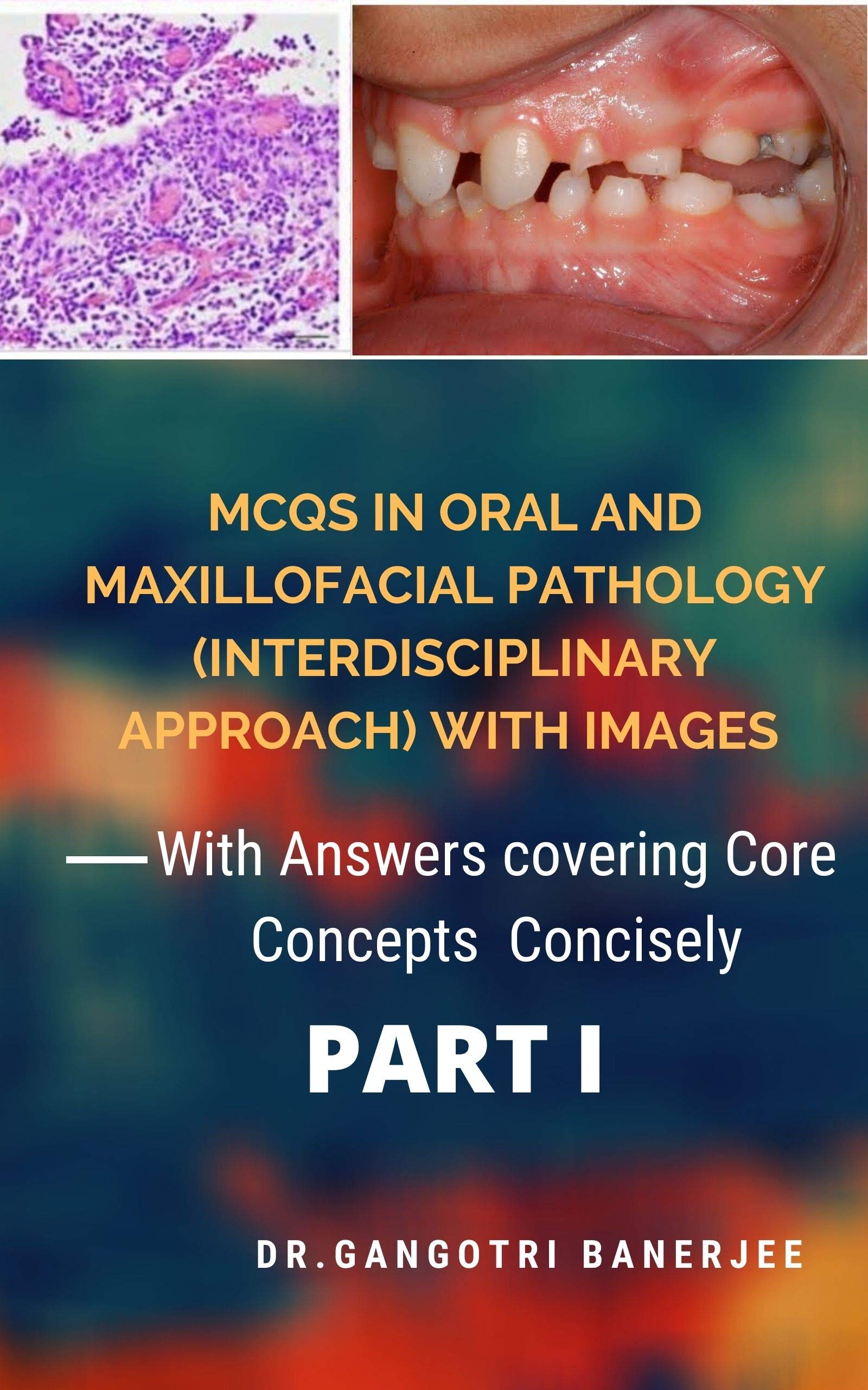 MCQS IN ORAL AND MAXILLOFACIAL PATHOLOGY (INTERDISCIPLINARY APPROACH ...