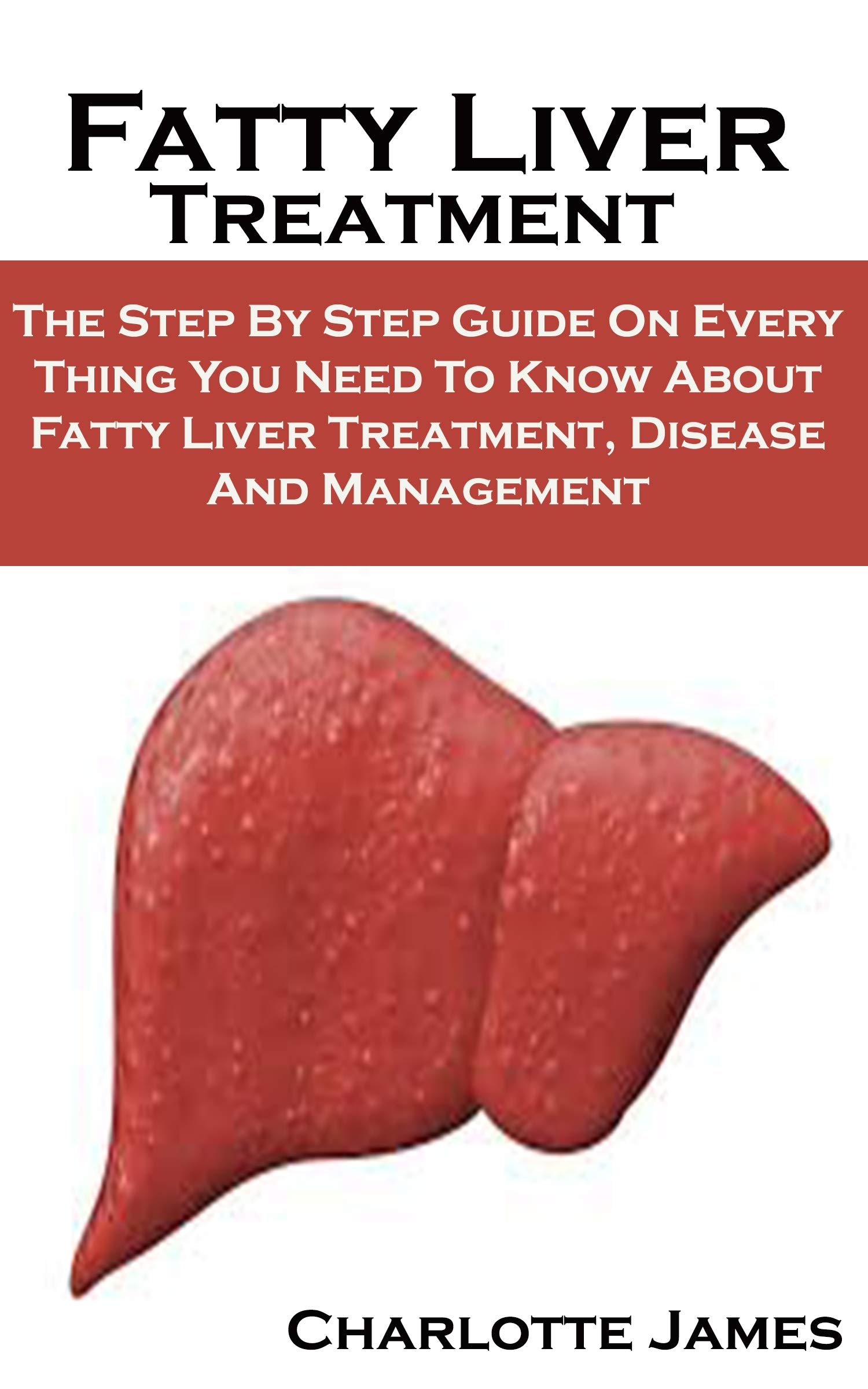 Fatty Liver Treatment: Fatty Liver Treatment: The Step By Step Guide On ...