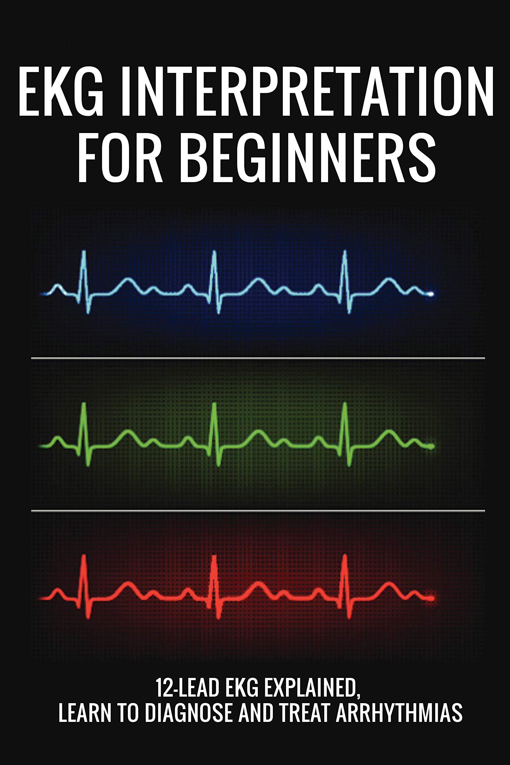 EKG Interpretation For Beginners: 12-Lead EKG Explained, Learn To ...