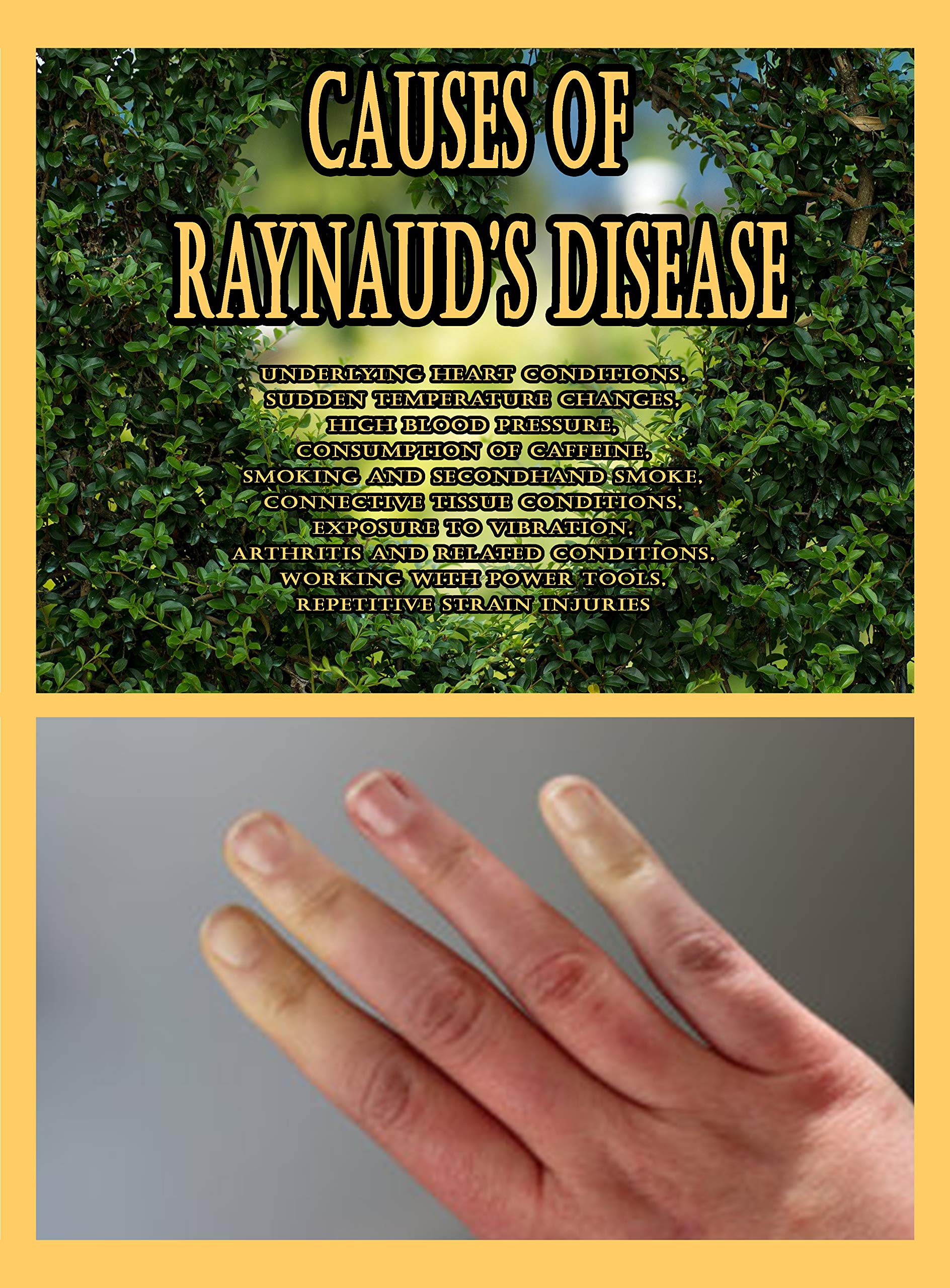 Causes of Raynaud’s Disease: Underlying Heart Conditions, Sudden ...