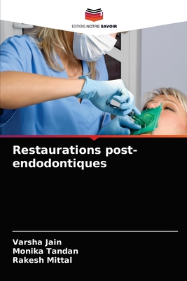 Restaurations post-endodontiques by Varsha Jain | Goodreads