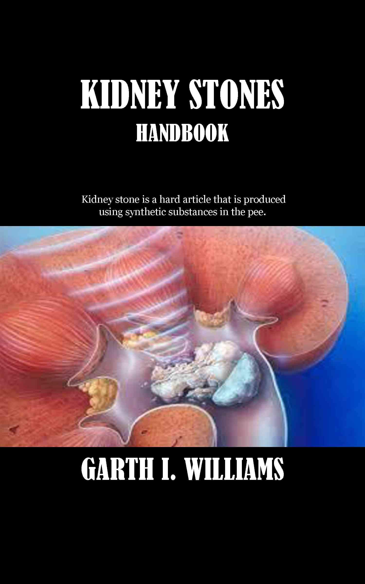 KIDNEY STONES HANDBOOK: Kidney stone is a hard article that is produced ...