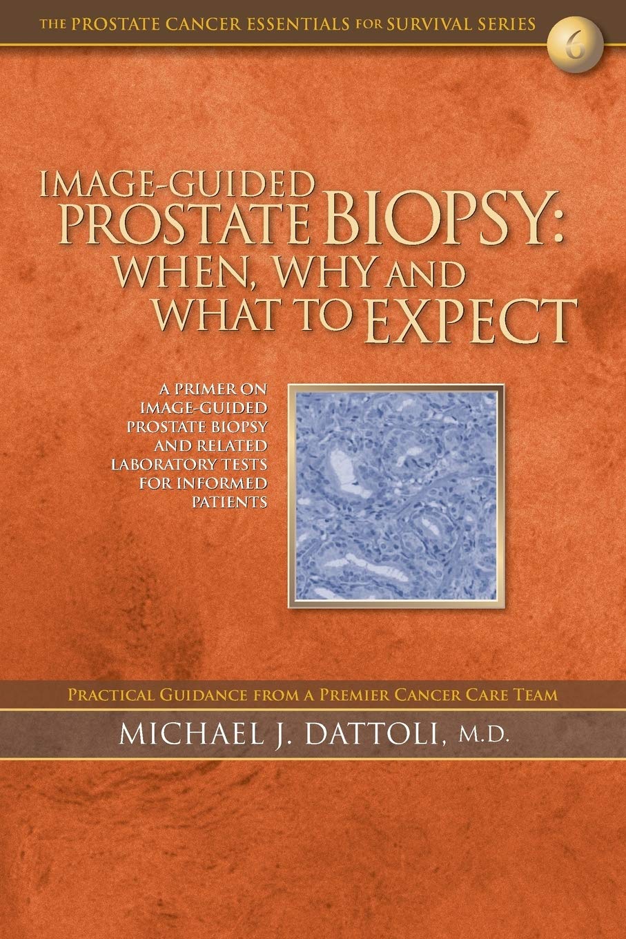 Image Guided Prostate Biopsy When Why And What To Expect By Michale J