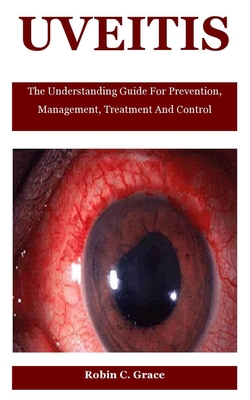 Uveitis: The Understanding Guide For Prevention, Management, Treatment ...