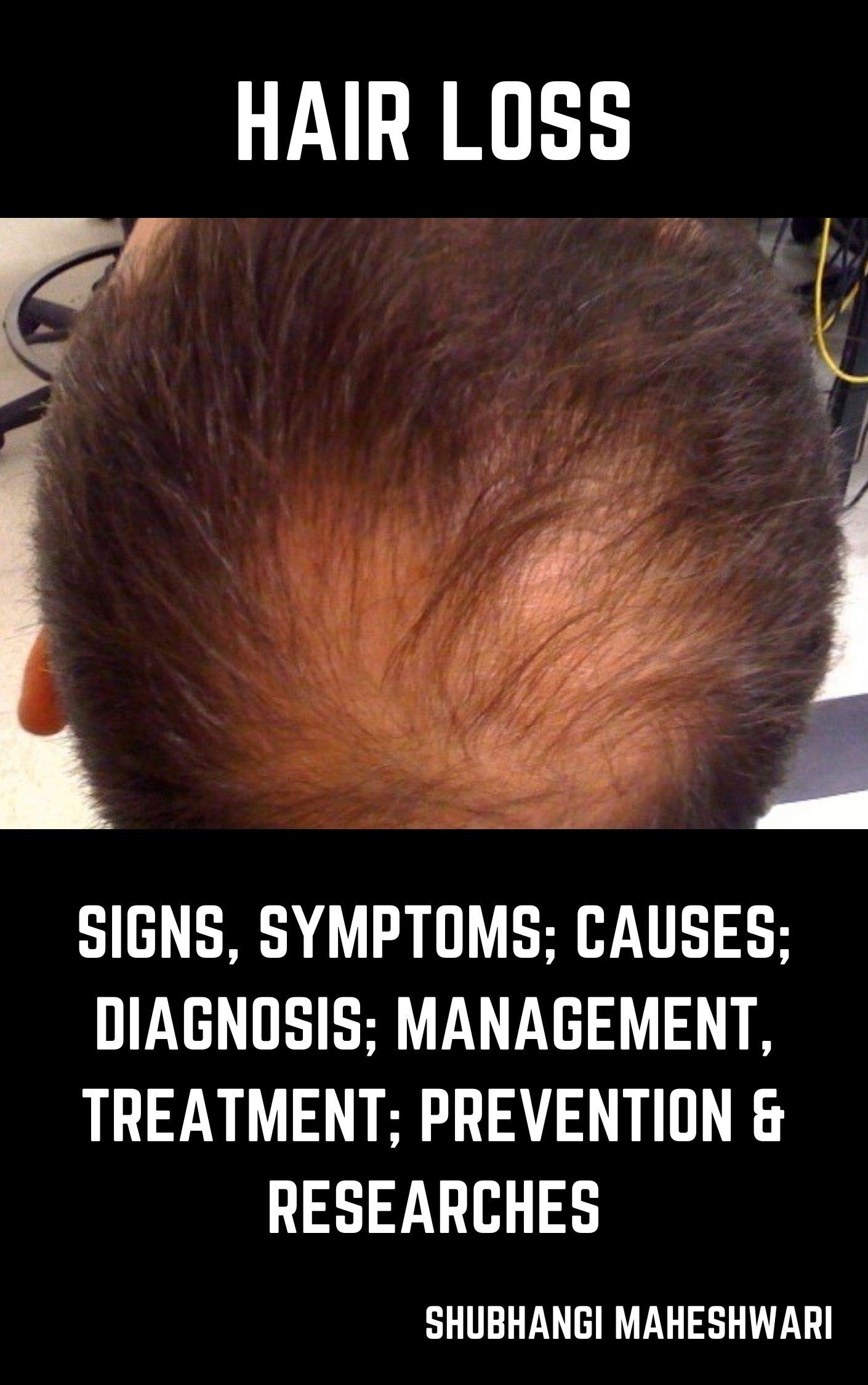 Hair Loss: Signs, Symptoms; Causes; Diagnosis; Management, Treatment ...