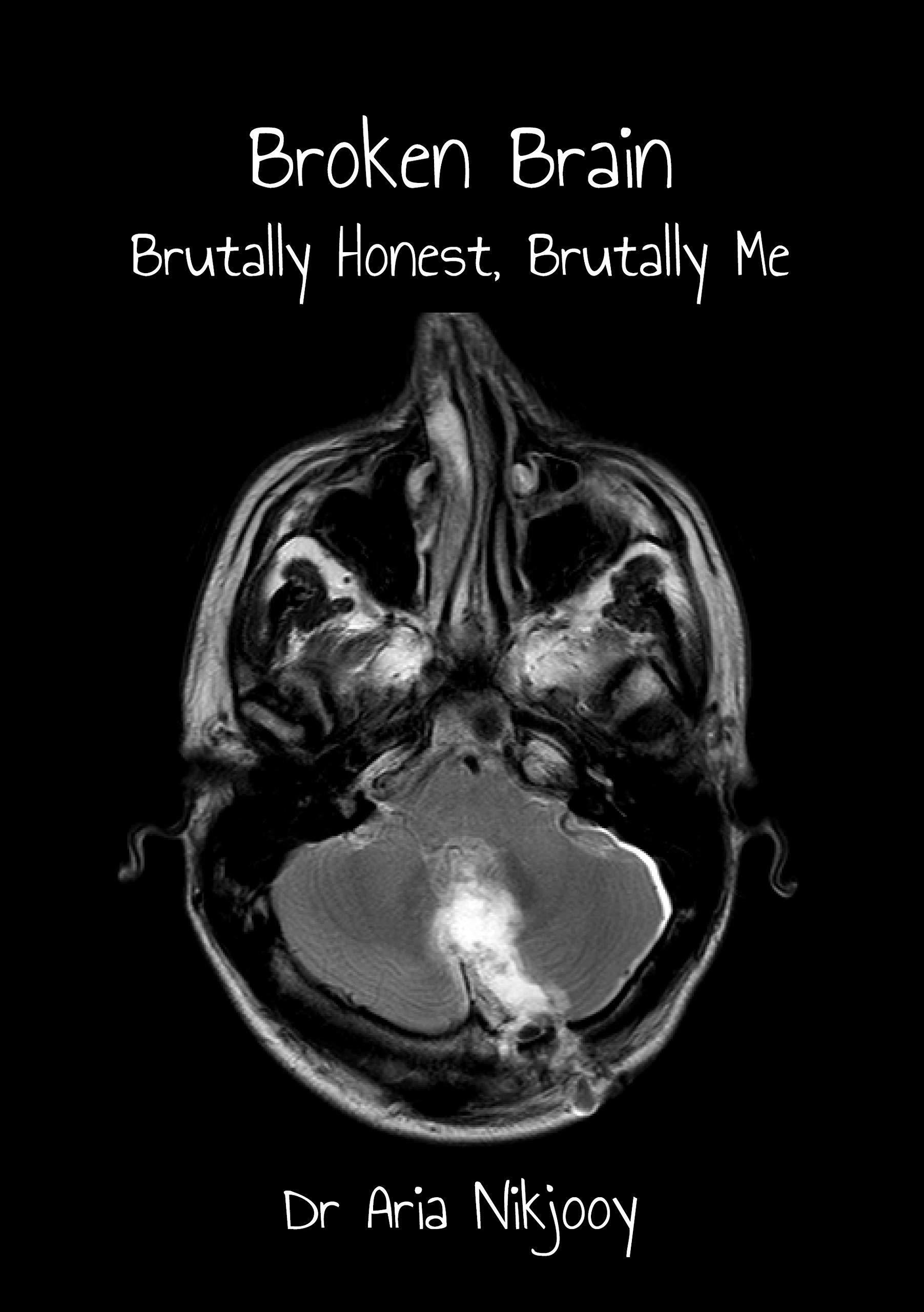 Broken Brain: Brutally Honest, Brutally Me by Aria Nikjooy | Goodreads