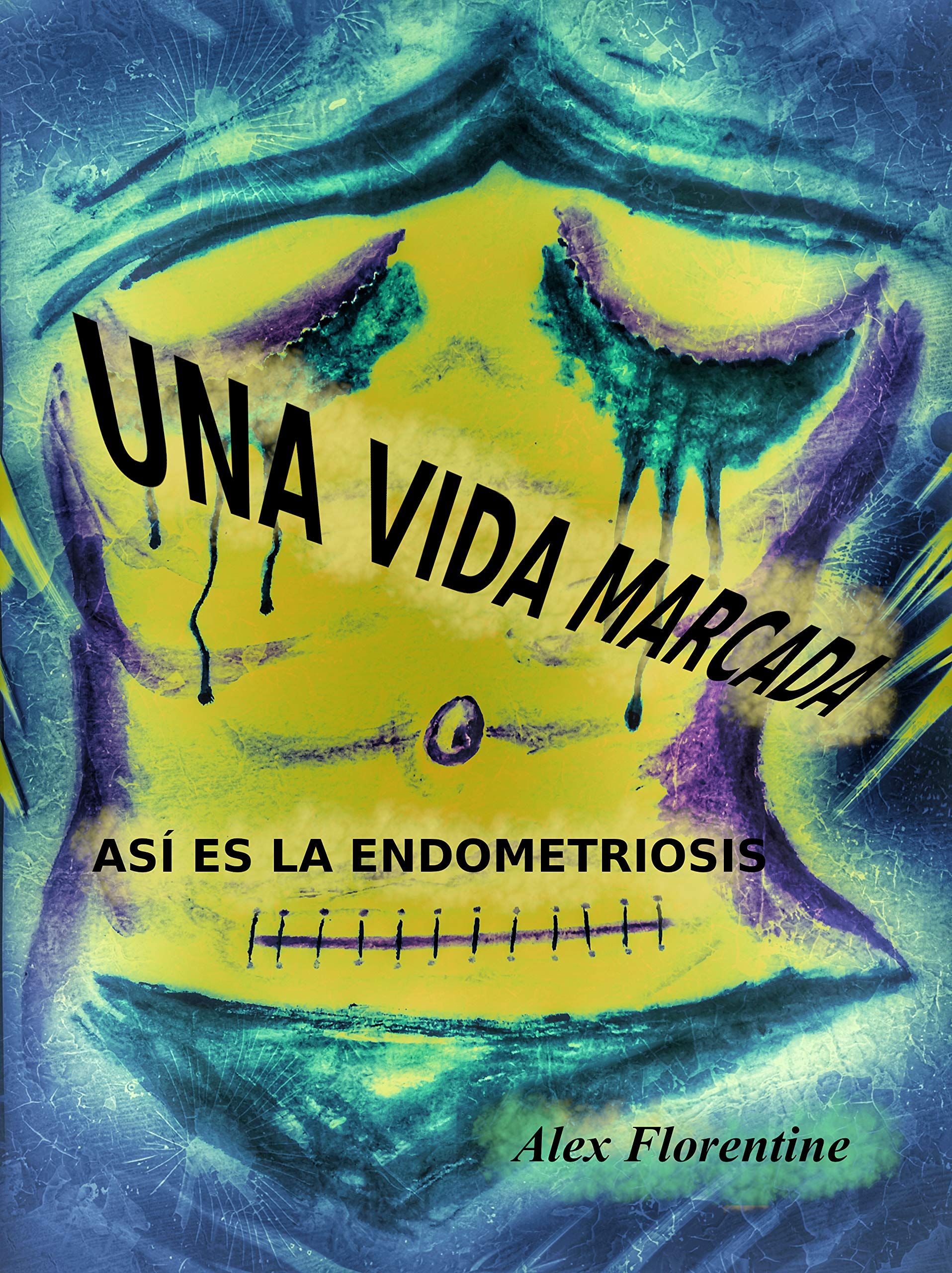 Una vida marcada: Así es la endometriosis by Alex Florentine | Goodreads