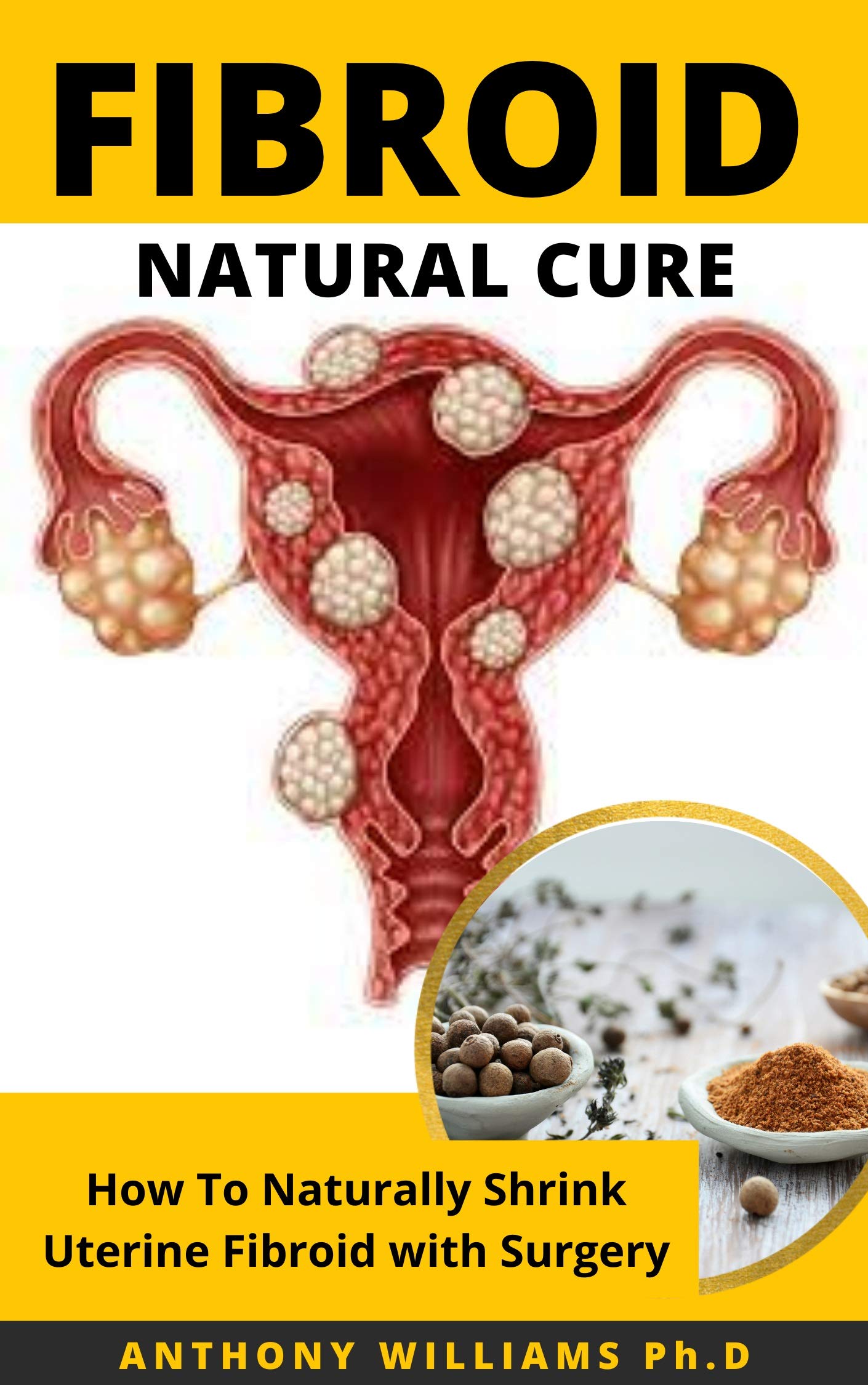 FIBROID NATURAL CURE: Trusted Guide to Shrinking Uterine Fibroid ...