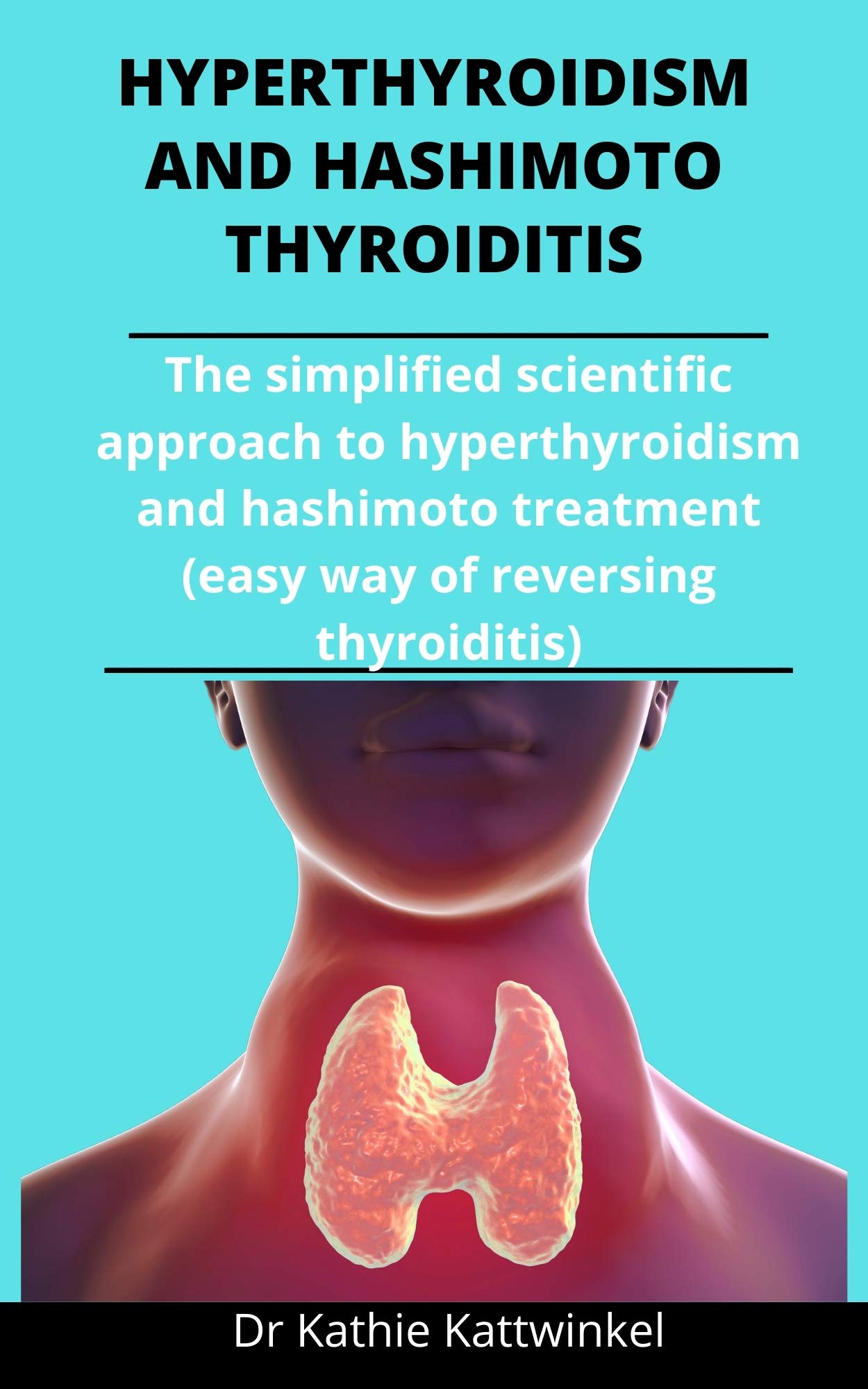 Hypothyroidism And Hashimoto Thyroiditis: The Simplified Scientific ...