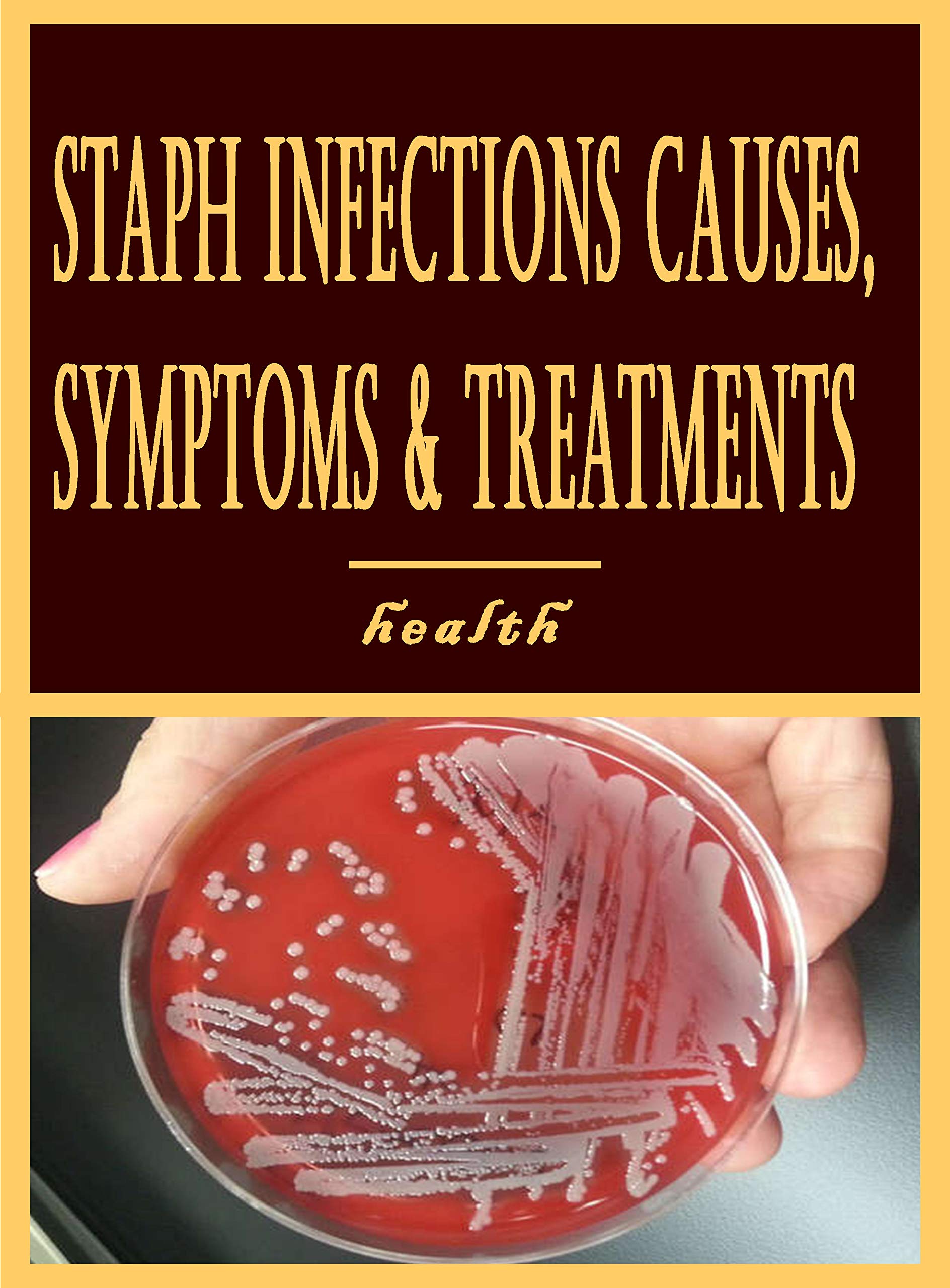 Staph Infections Causes, Symptoms & Treatments by dr. nivandra suzzens ...