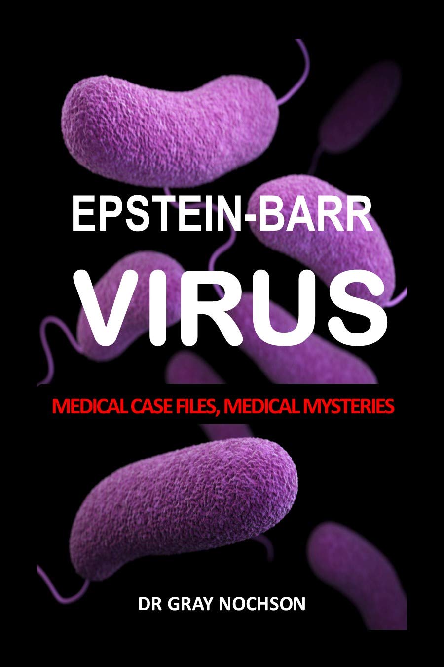 EPSTEIN-BARR VIRUS: MEDICAL CASE FILES, MEDICAL MYSTERIES”, by DR GRAY ...