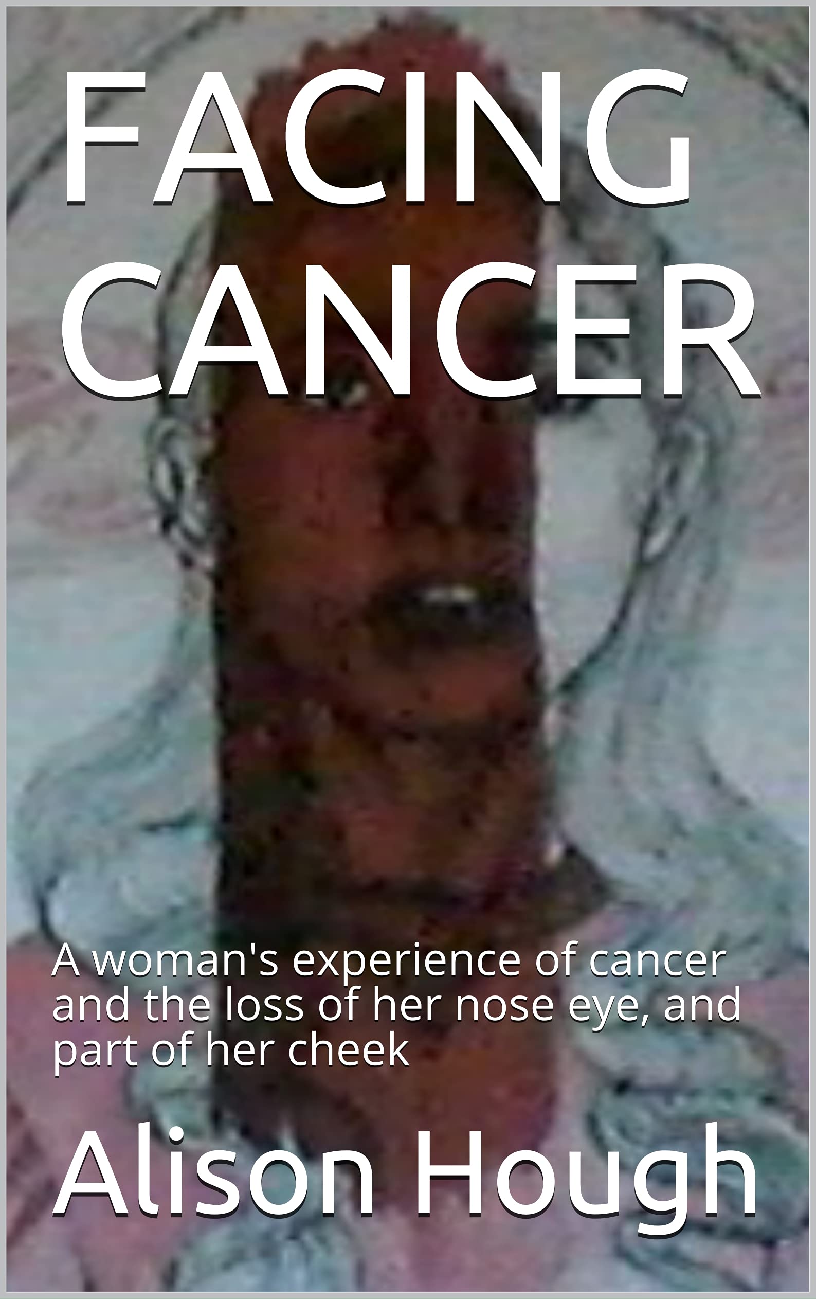 FACING CANCER: A woman's experience of cancer and the loss of her nose ...