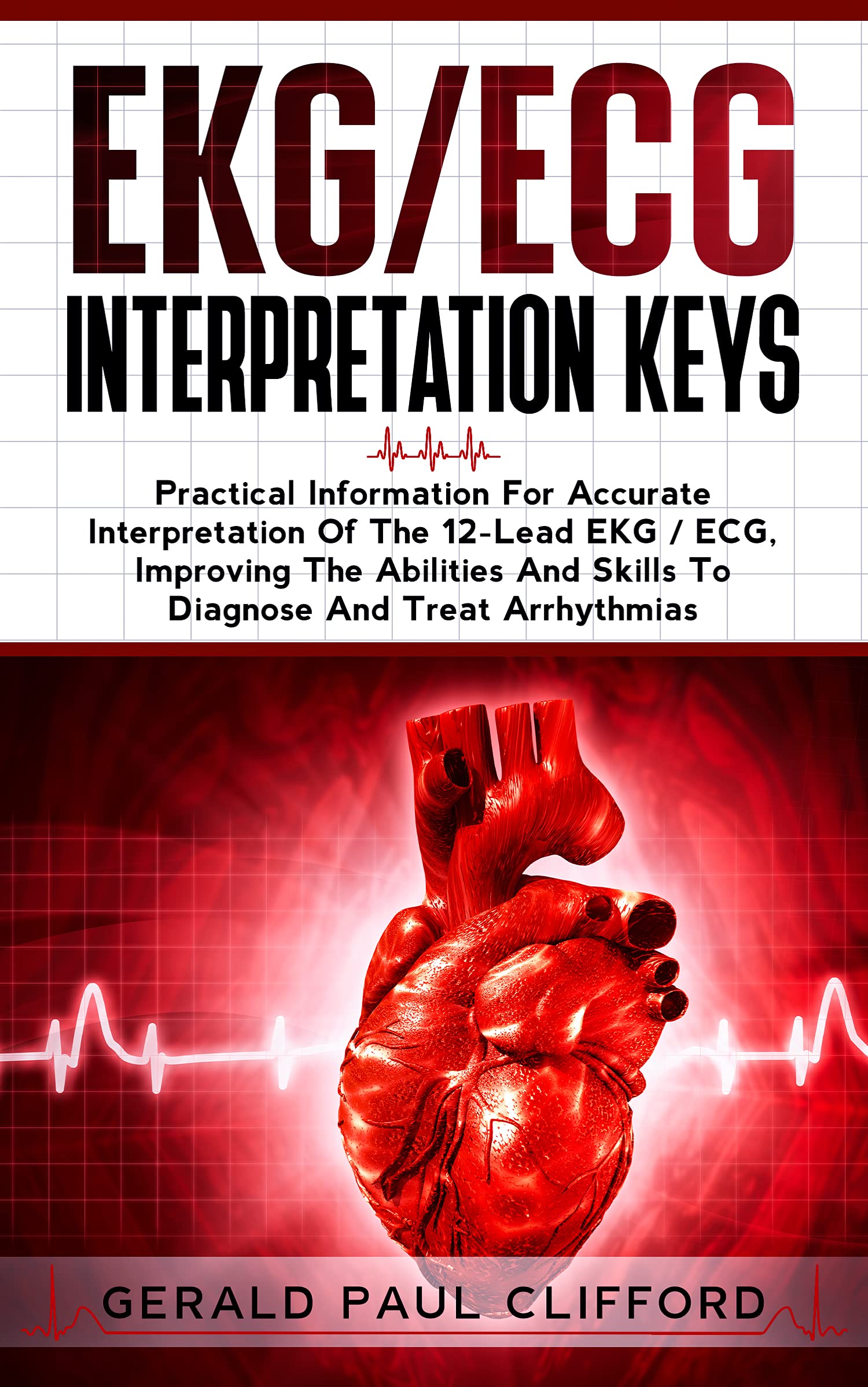 EKG/ECG Interpretation Keys: Practical Information For Accurate ...