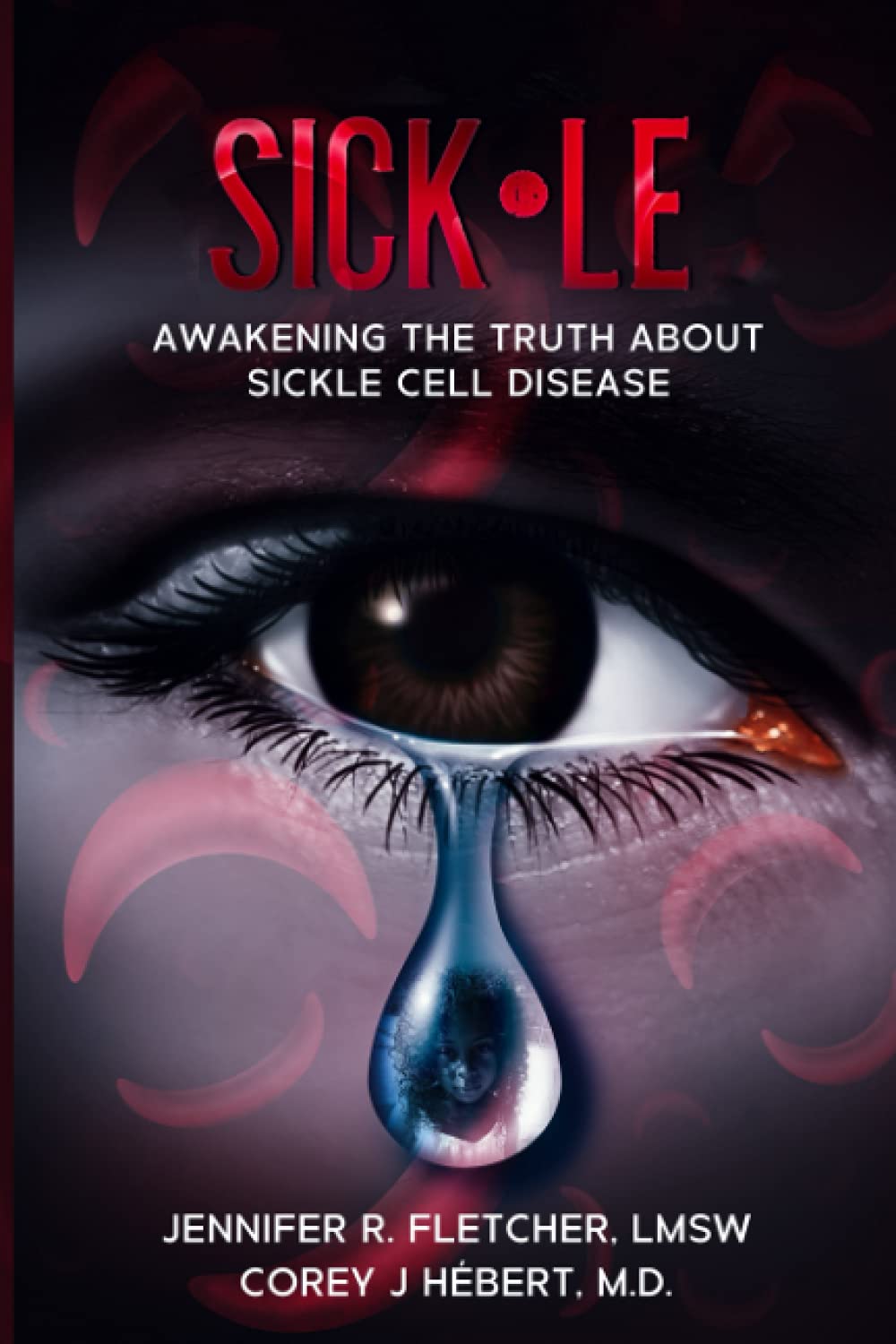 Sick·le: Awakening the Truth about Sickle Cell Disease by Jennifer ...