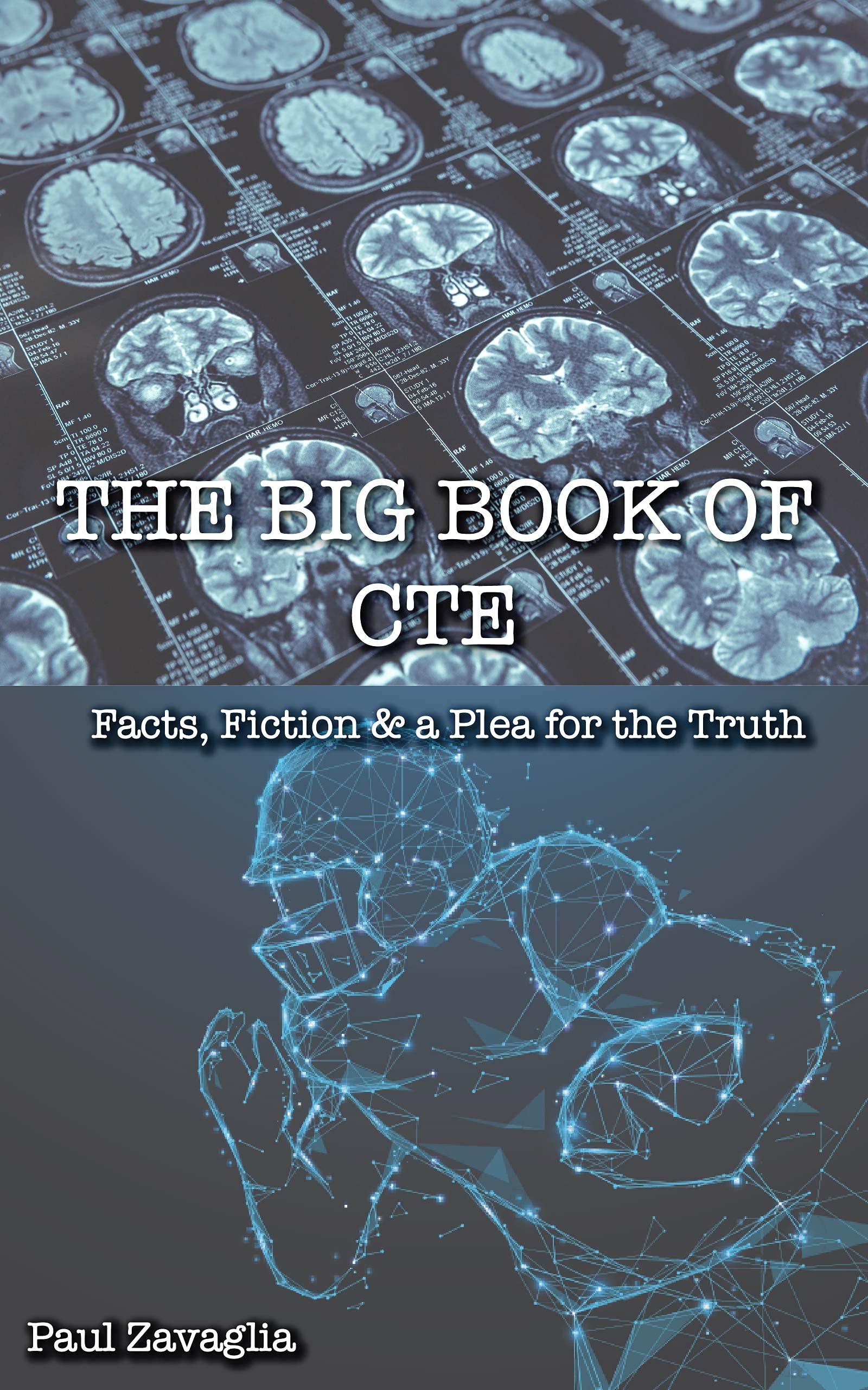 The Big Book of CTE: Facts, Fiction & a Plea for the Truth by Paul ...
