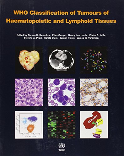 WHO Classification of Tumours of Haematopoietic and Lymphoid Tissue [OP ...