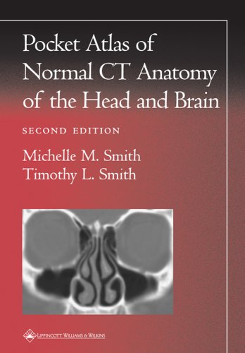 Pocket Atlas of Normal CT Anatomy of the Head and Brain (Radiology ...