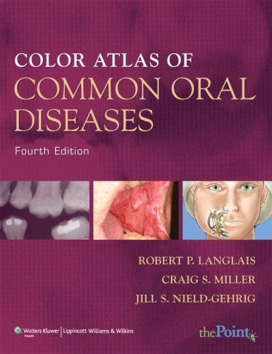 Color Atlas of Common Oral Diseases by Robert P. Langlais DDS MS, LWW ...