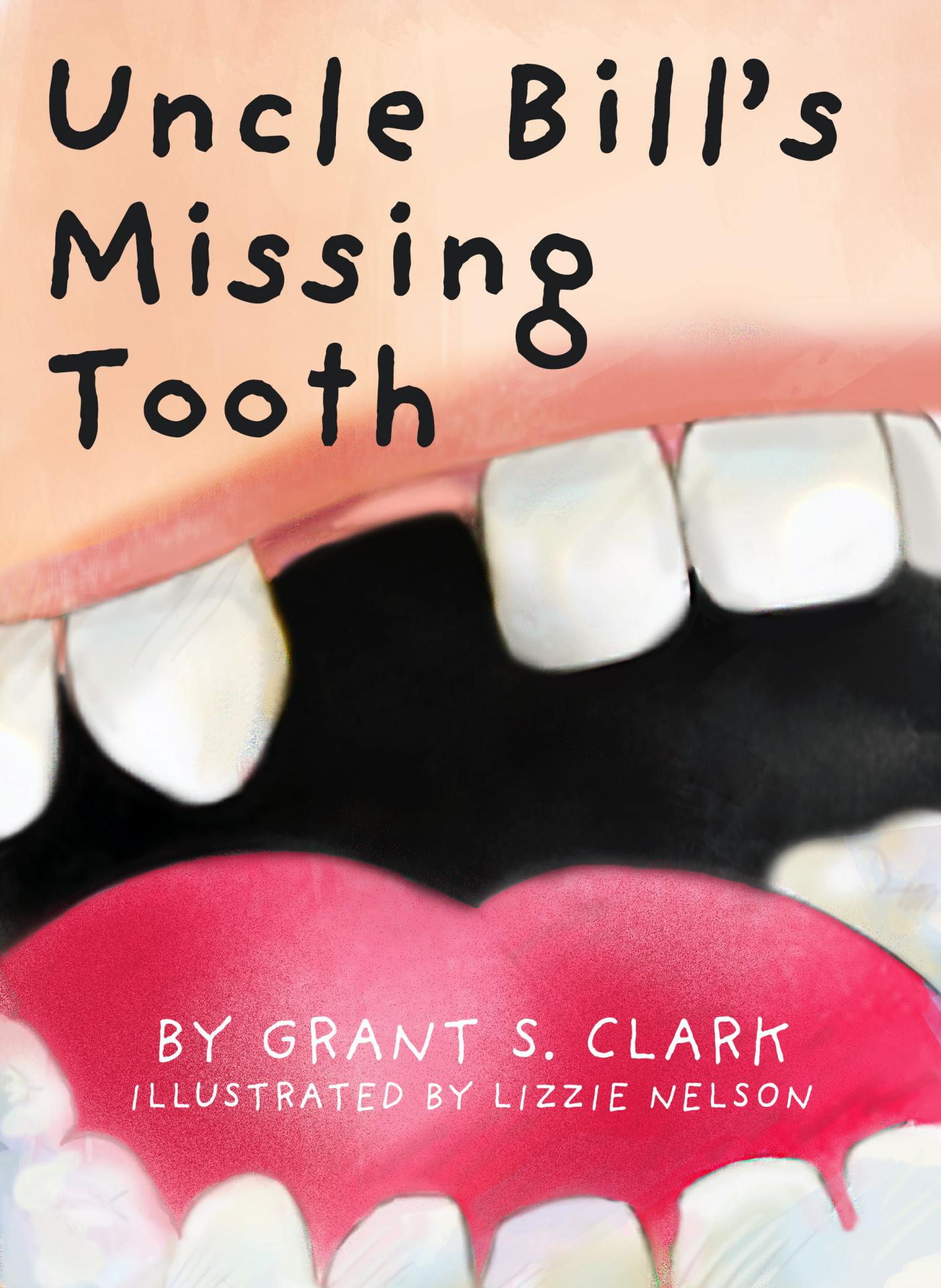 Uncle Bill's Missing Tooth by Grant S. Clark | Goodreads