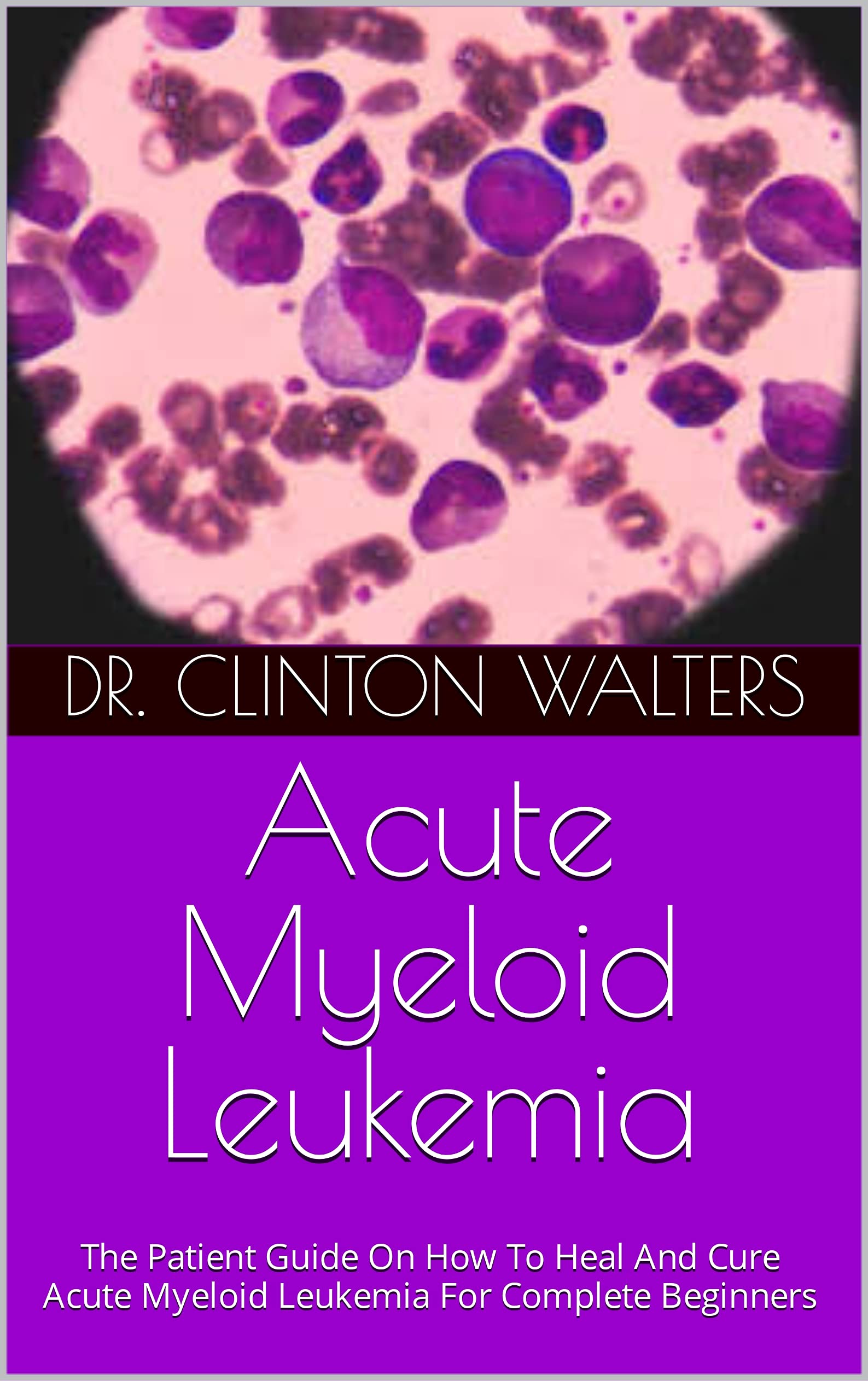 Acute Myeloid Leukemia: The Patient Guide On How To Heal And Cure Acute ...
