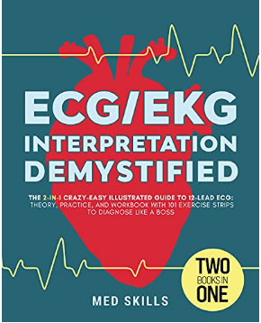 ECG/EKG Interpretation Demystified • The 2-in-1 Crazy-Easy Illustrated ...