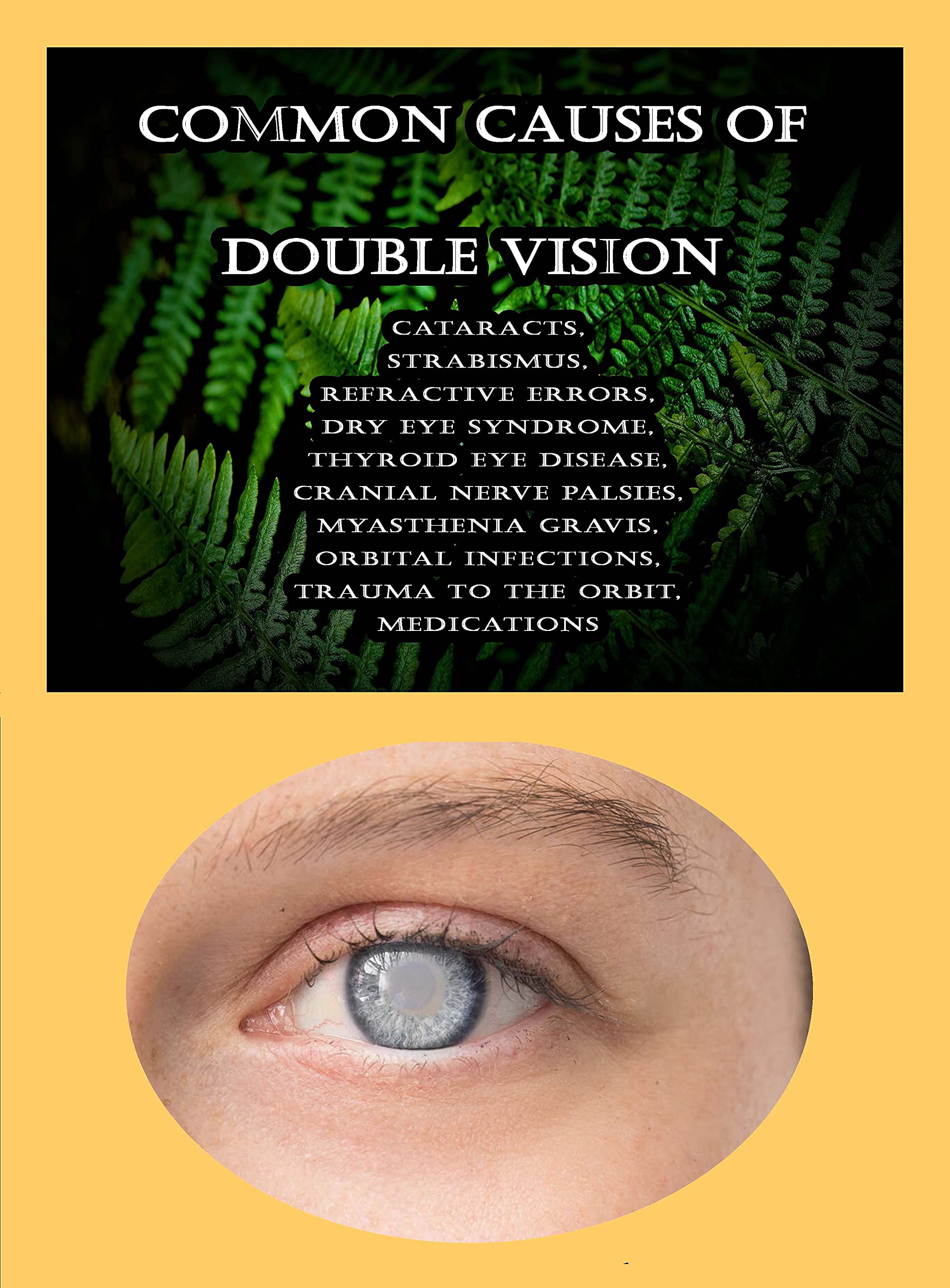 Common Causes Of Double Vision: Cataracts, Strabismus, Refractive ...