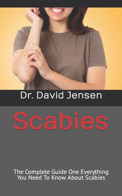 Scabies: The Complete Guide One Everything You Need To Know About ...
