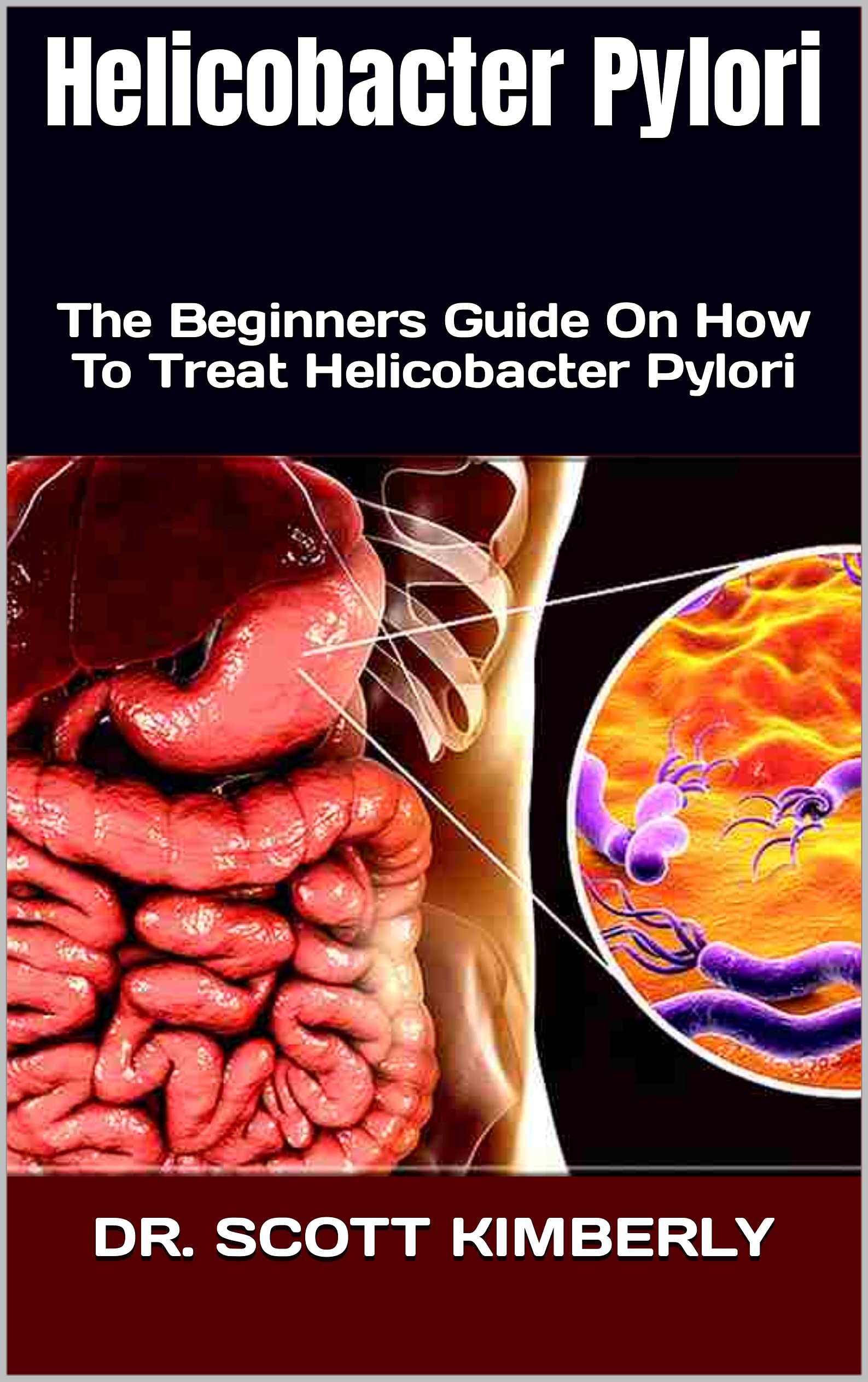 Helicobacter Pylori : The Beginners Guide On How To Treat Helicobacter ...
