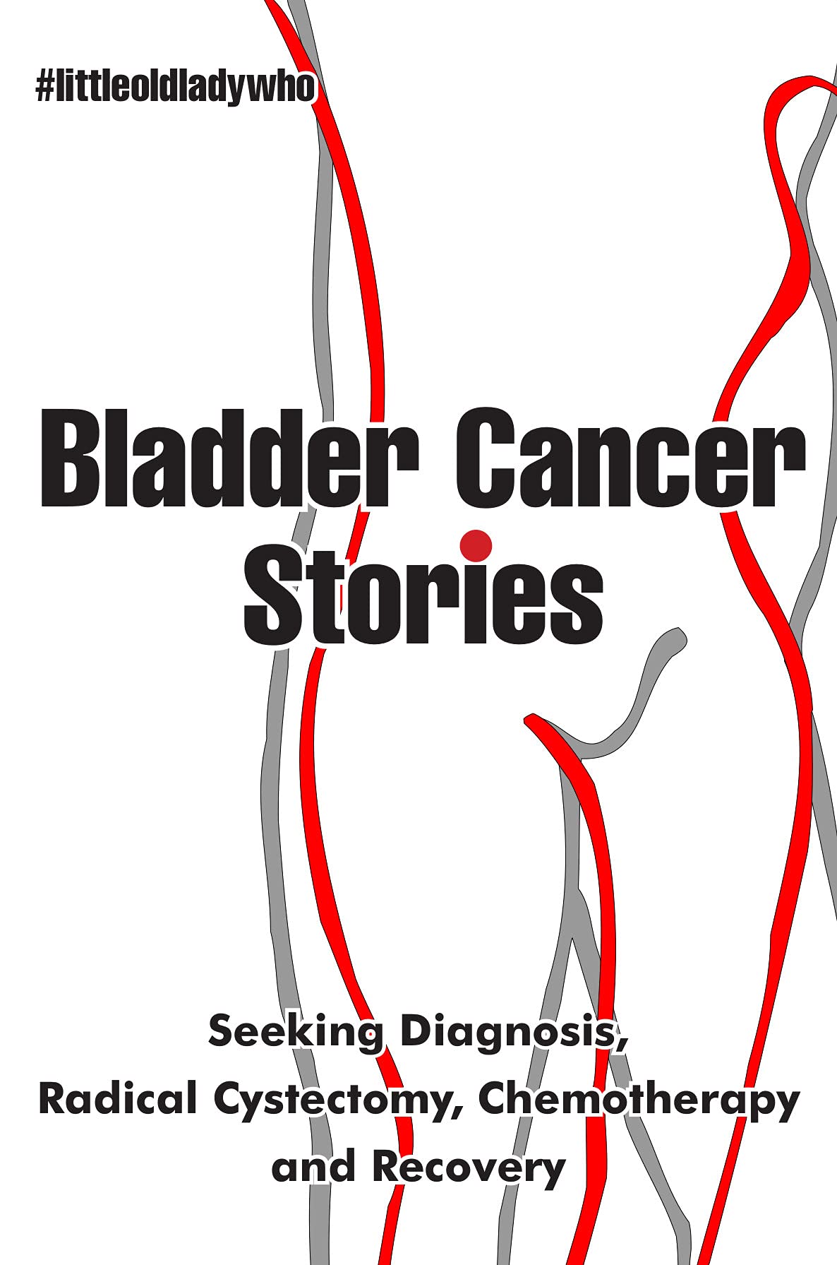 Bladder Cancer Stories: Seeking Diagnosis, Radical Cystectomy ...