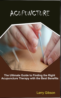 Acupuncture: The Ultimate Guide to Finding the Right Acupuncture ...