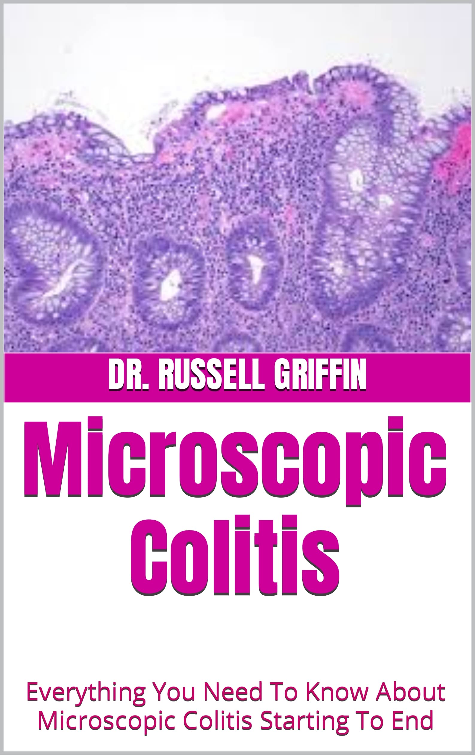 Microscopic Colitis : Everything You Need To Know About Microscopic ...