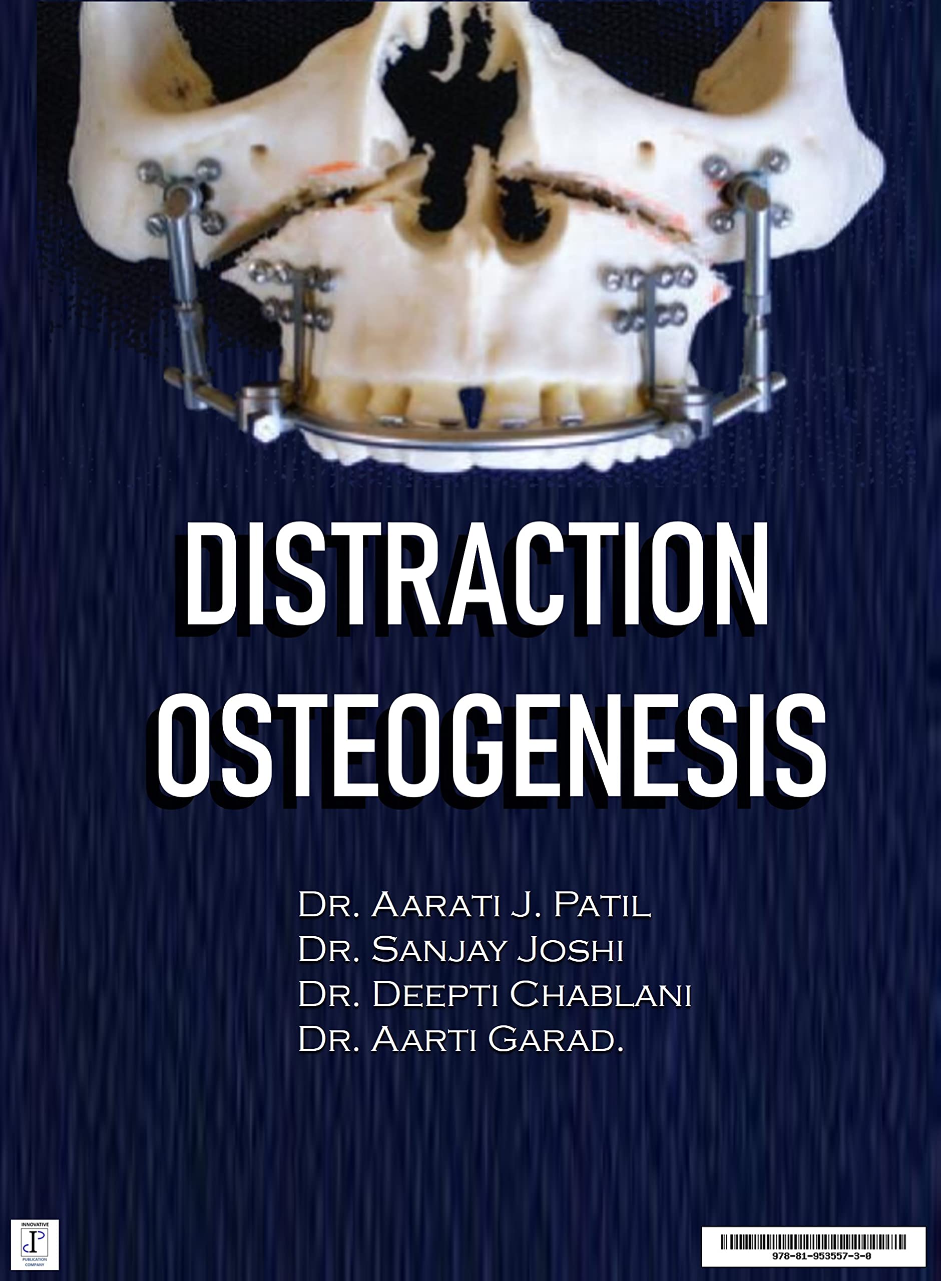 Distraction Osteogenesis by Aarati J. Patil | Goodreads