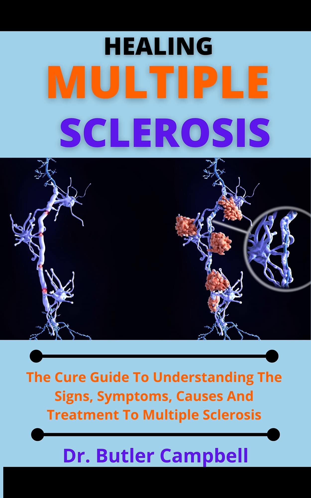 Healing Multiple Sclerosis: The Cure Guide To Understanding The Signs ...