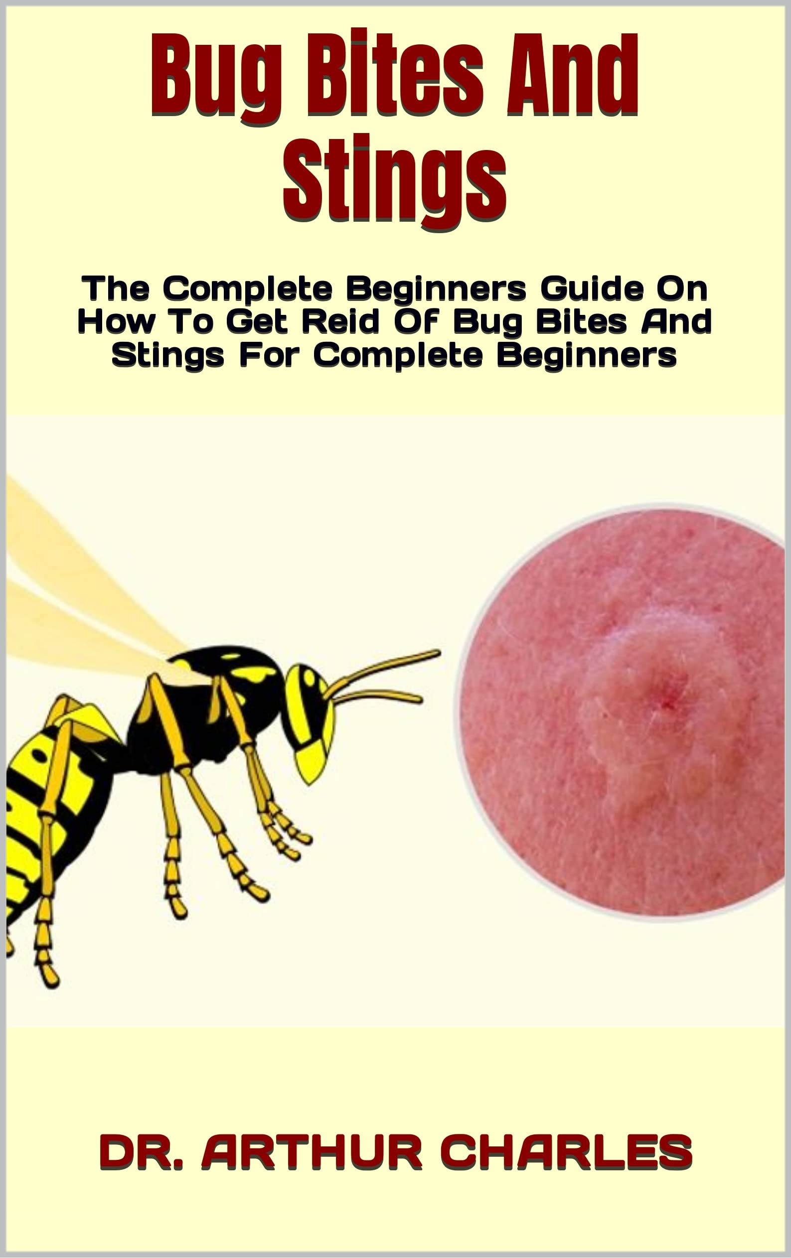 Bug Bites And Stings : The Complete Beginners Guide On How To Get Reid ...