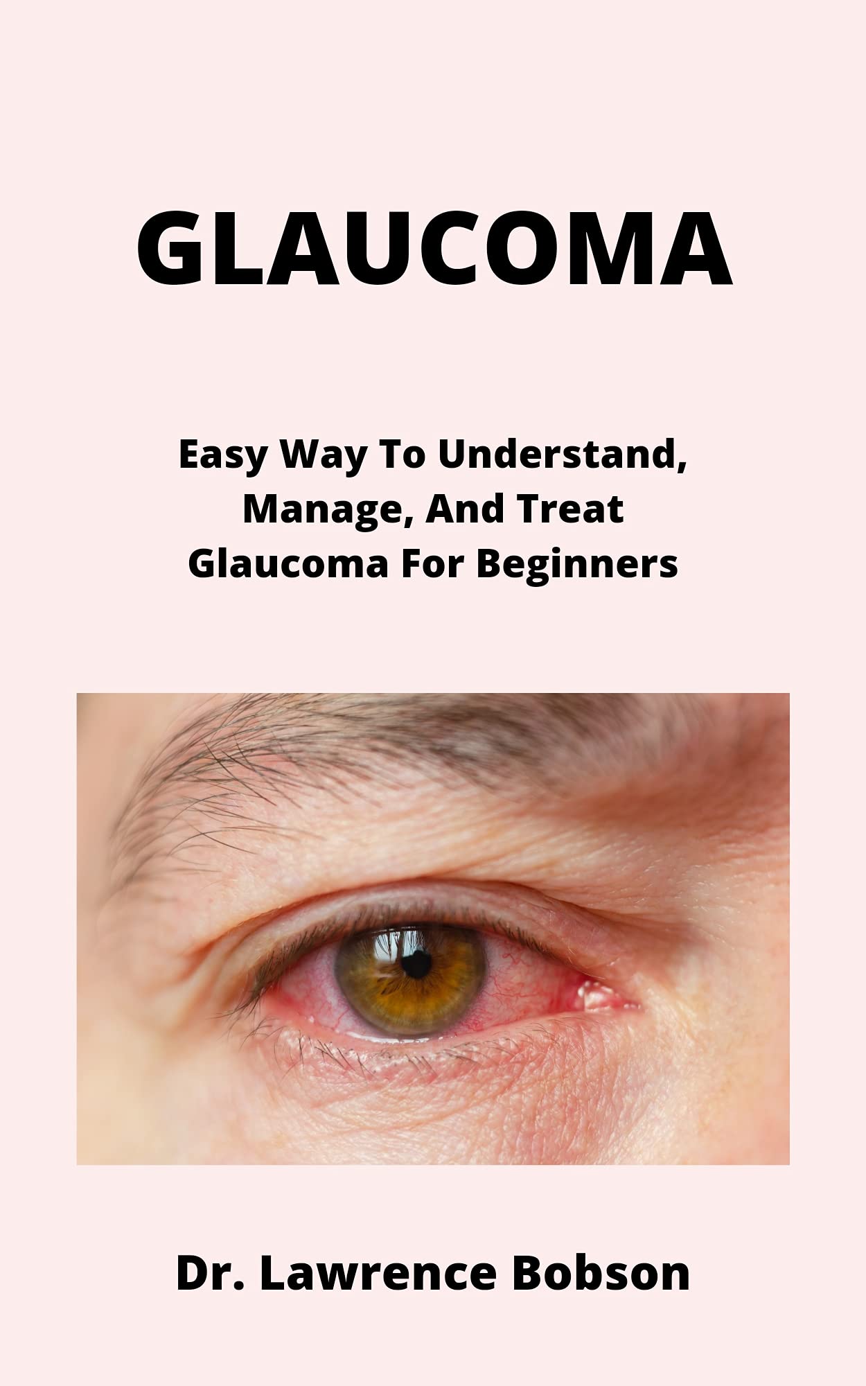 Glaucoma: Easy Way To Understand, Manage, And Treat Glaucoma For ...