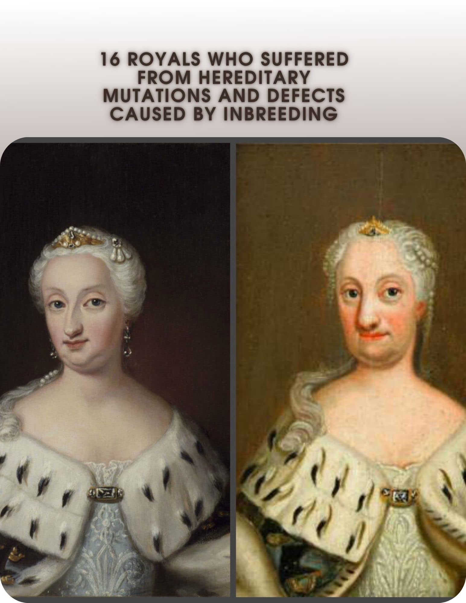 16 ROYALS WHO SUFFERED FROM HEREDITARY MUTATIONS AND DEFECTS CAUSED BY ...