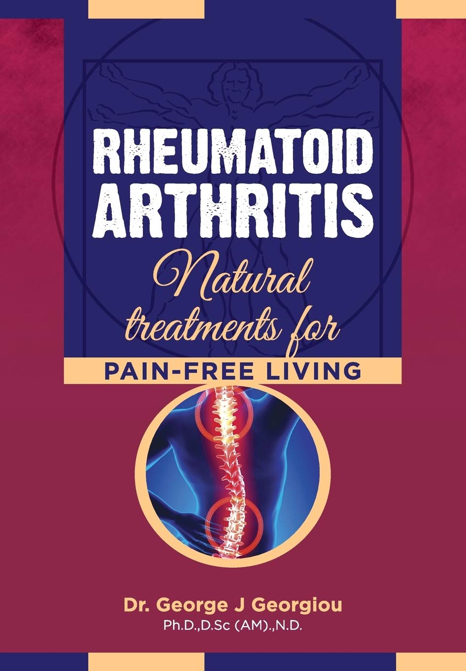 Rheumatoid Arthritis: Natural Treatments for Pain-Free Living by George ...