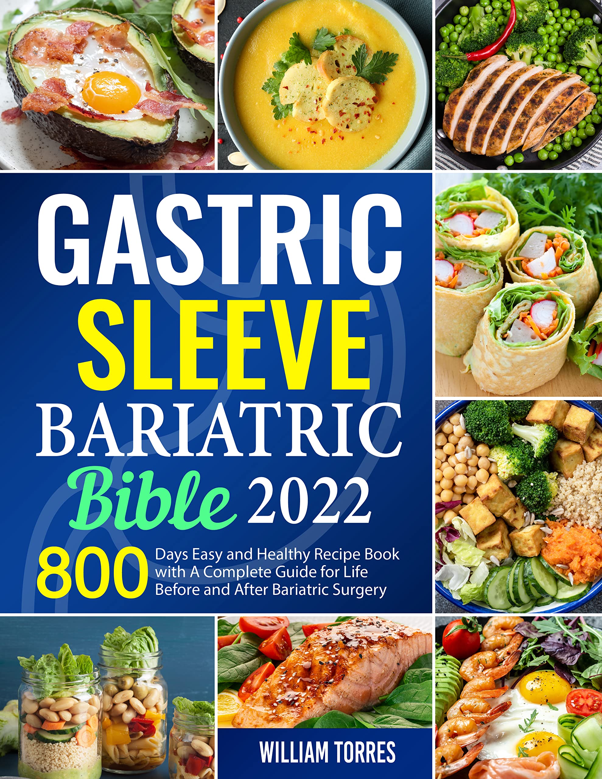 Gastric Sleeve Bariatric Bible 2022: 800 Days Easy and Healthy Recipe ...